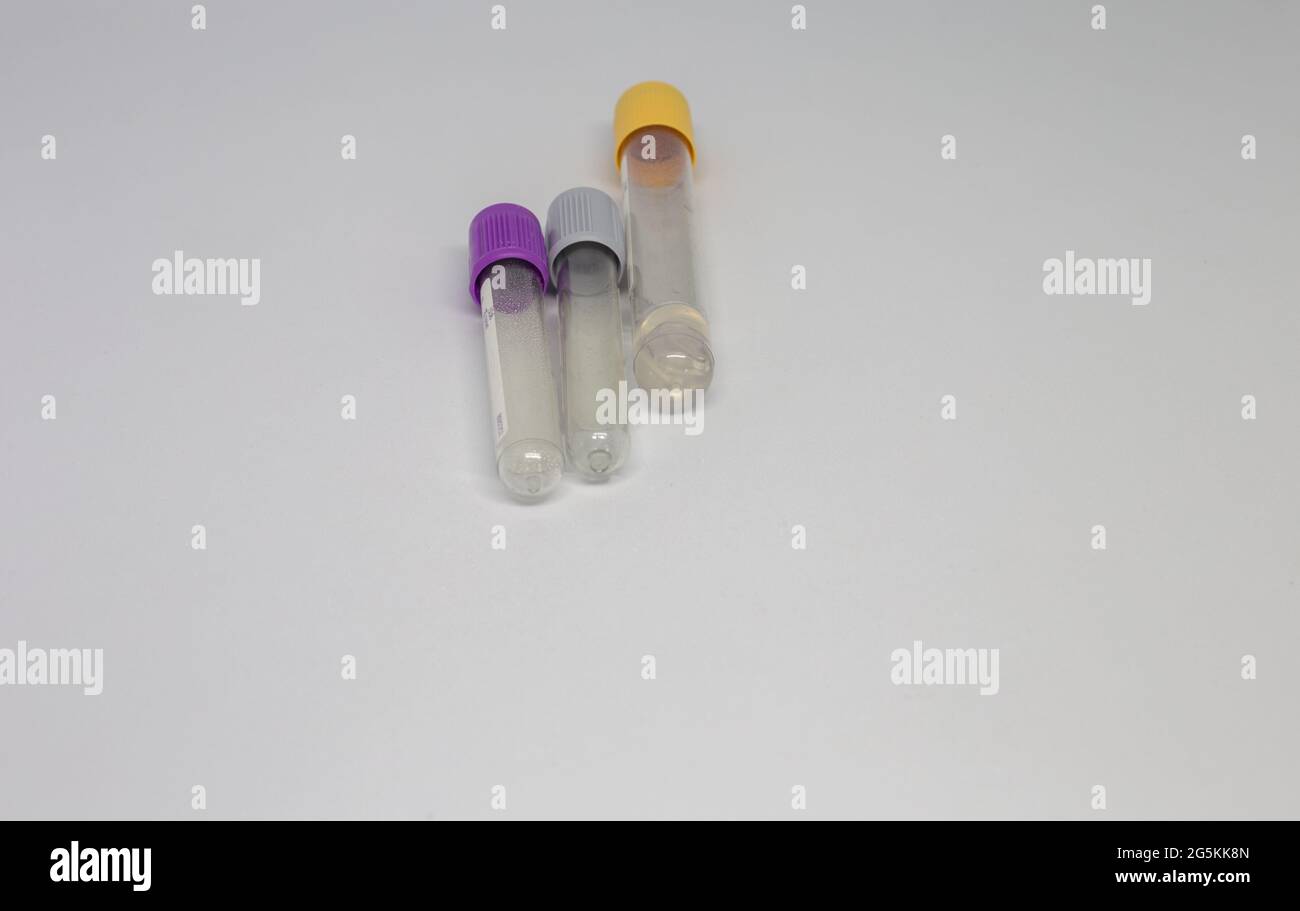 Top view of medical empty blood tubes isolated on white background ...