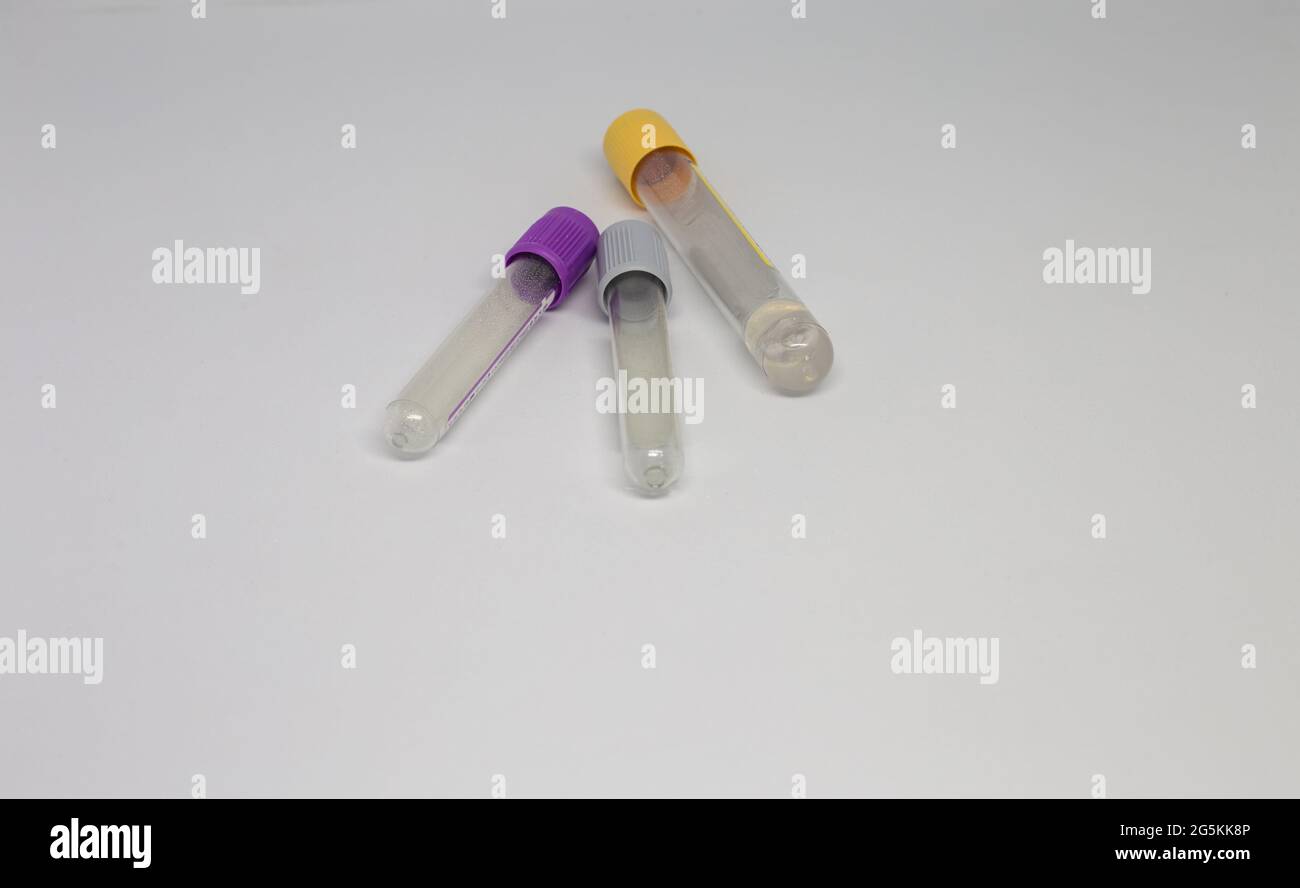 Top view of medical empty blood tubes isolated on white background ...