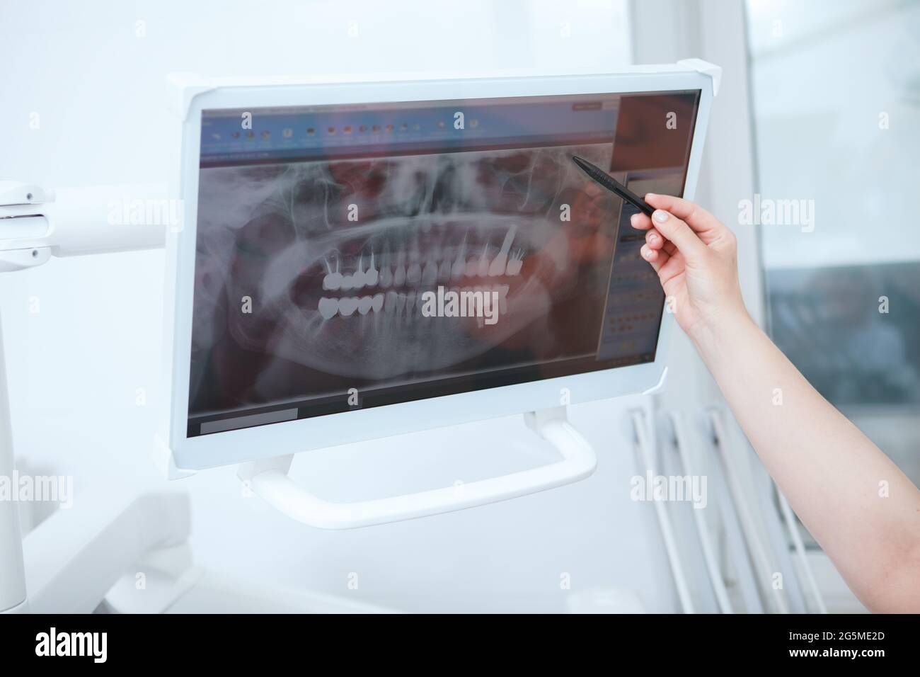 Denture scan hi-res stock photography and images - Alamy