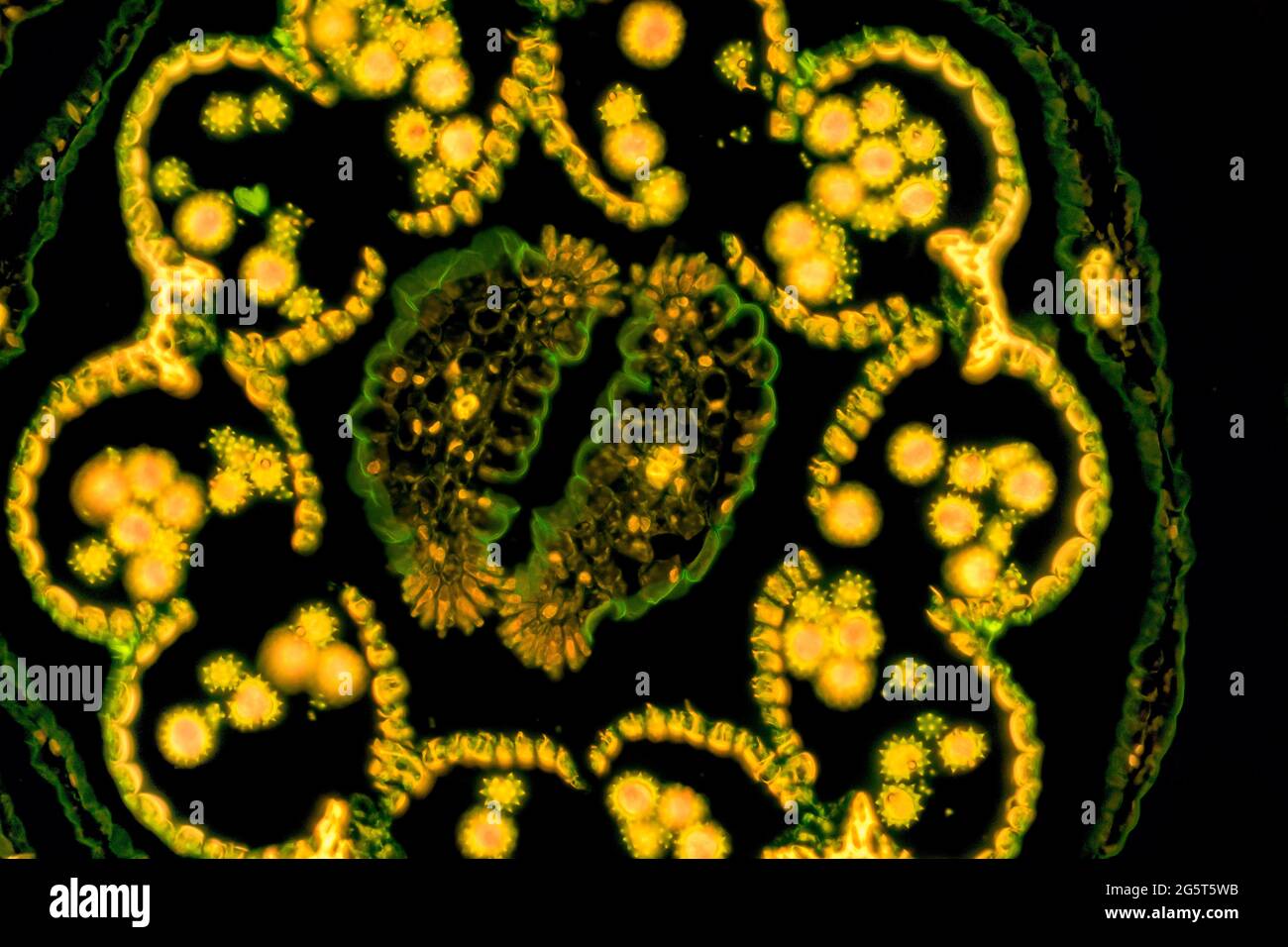 common daisy, lawn daisy, English daisy (Bellis perennis), cross ...