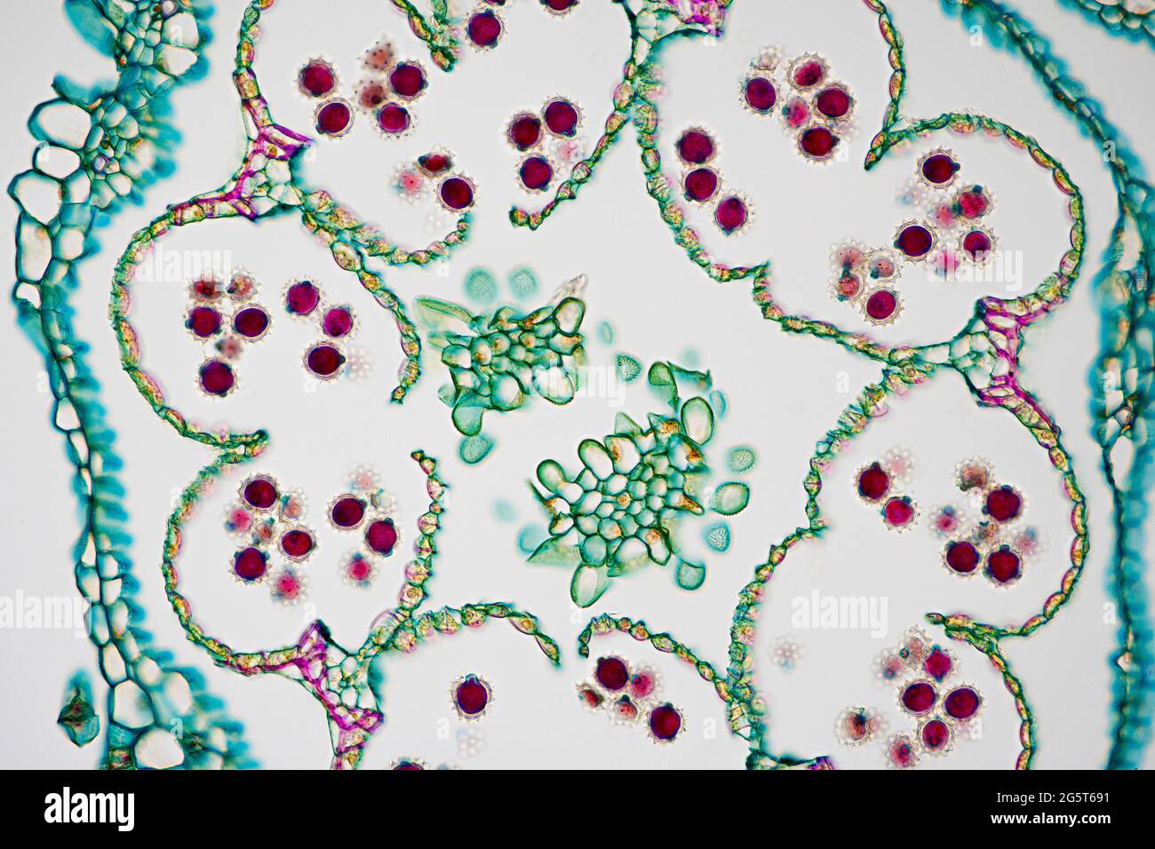 common daisy, lawn daisy, English daisy (Bellis perennis), cross ...