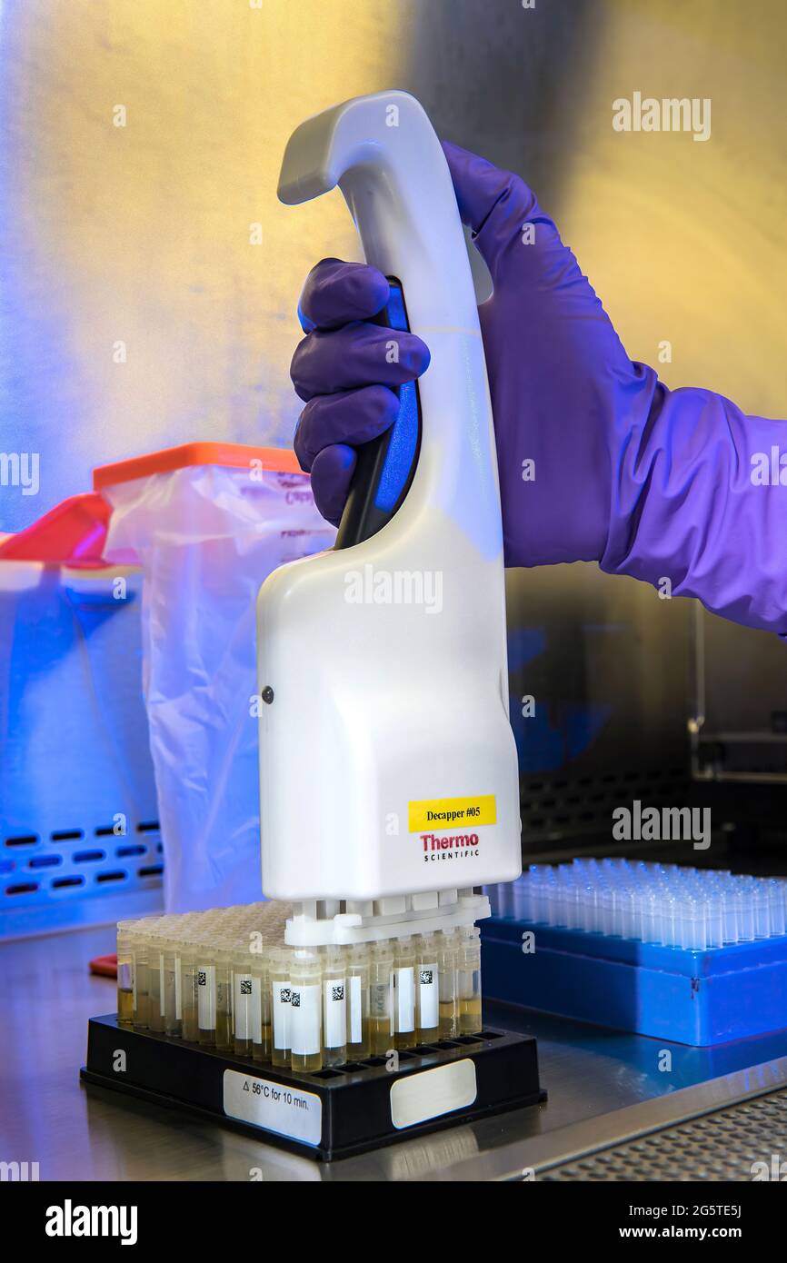 Centers for Disease Control and Prevention (CDC) scientists tested ...