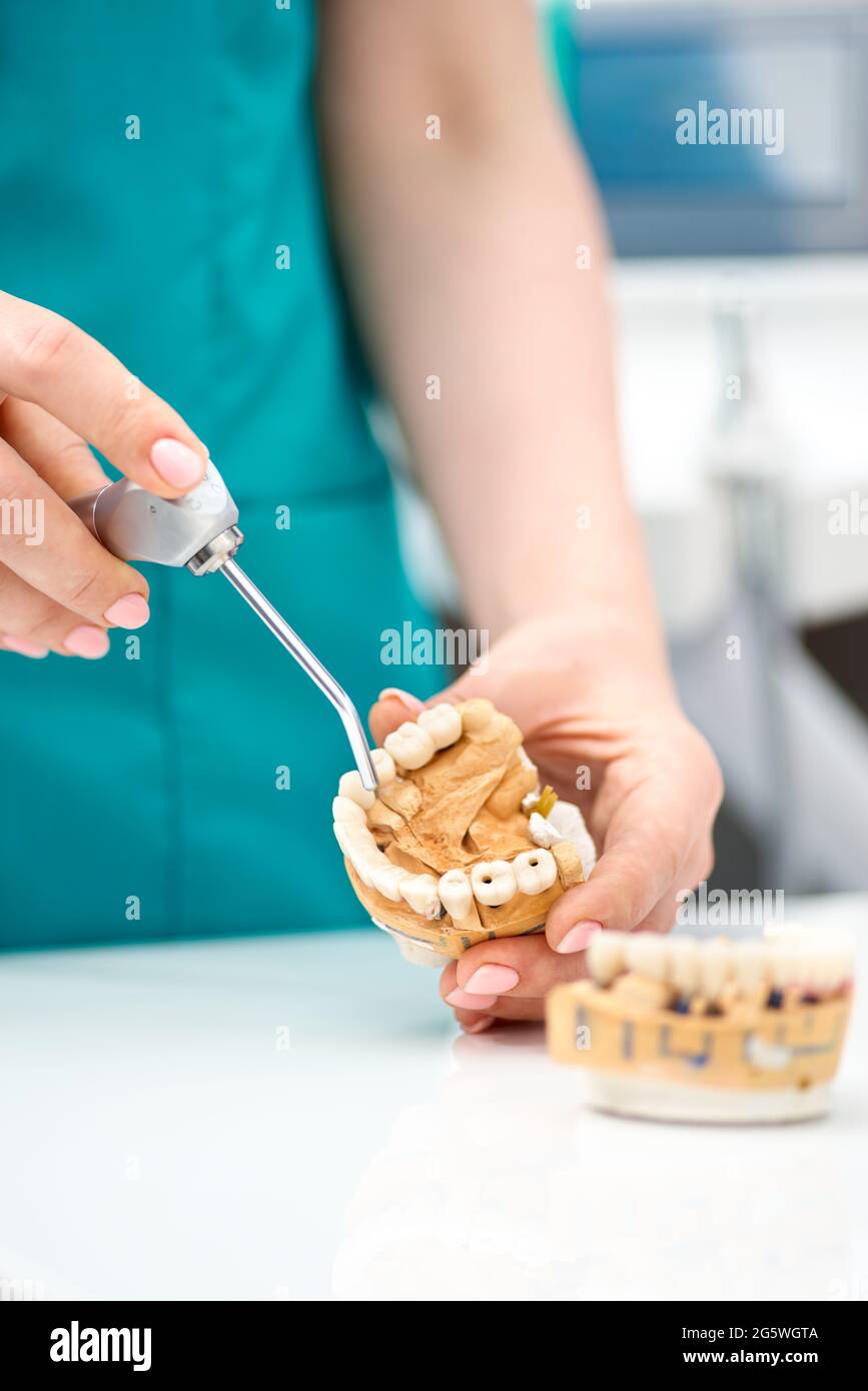 The dentist's hand holds an artificial jaw mock-up and shows the ...