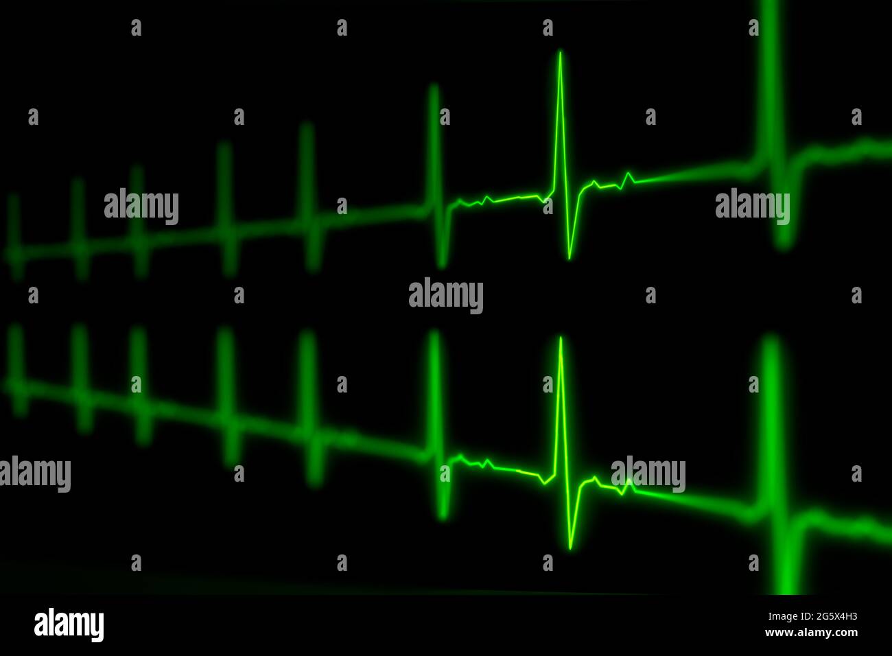 ECG or EKG pulse heartbeat of life sign green line 3D illustration ...