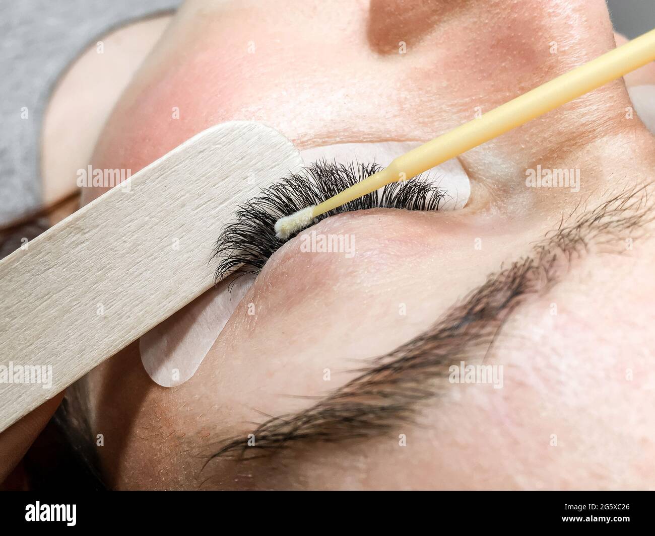 Close-up of the eyelash extension removal procedure. Portrait of a ...