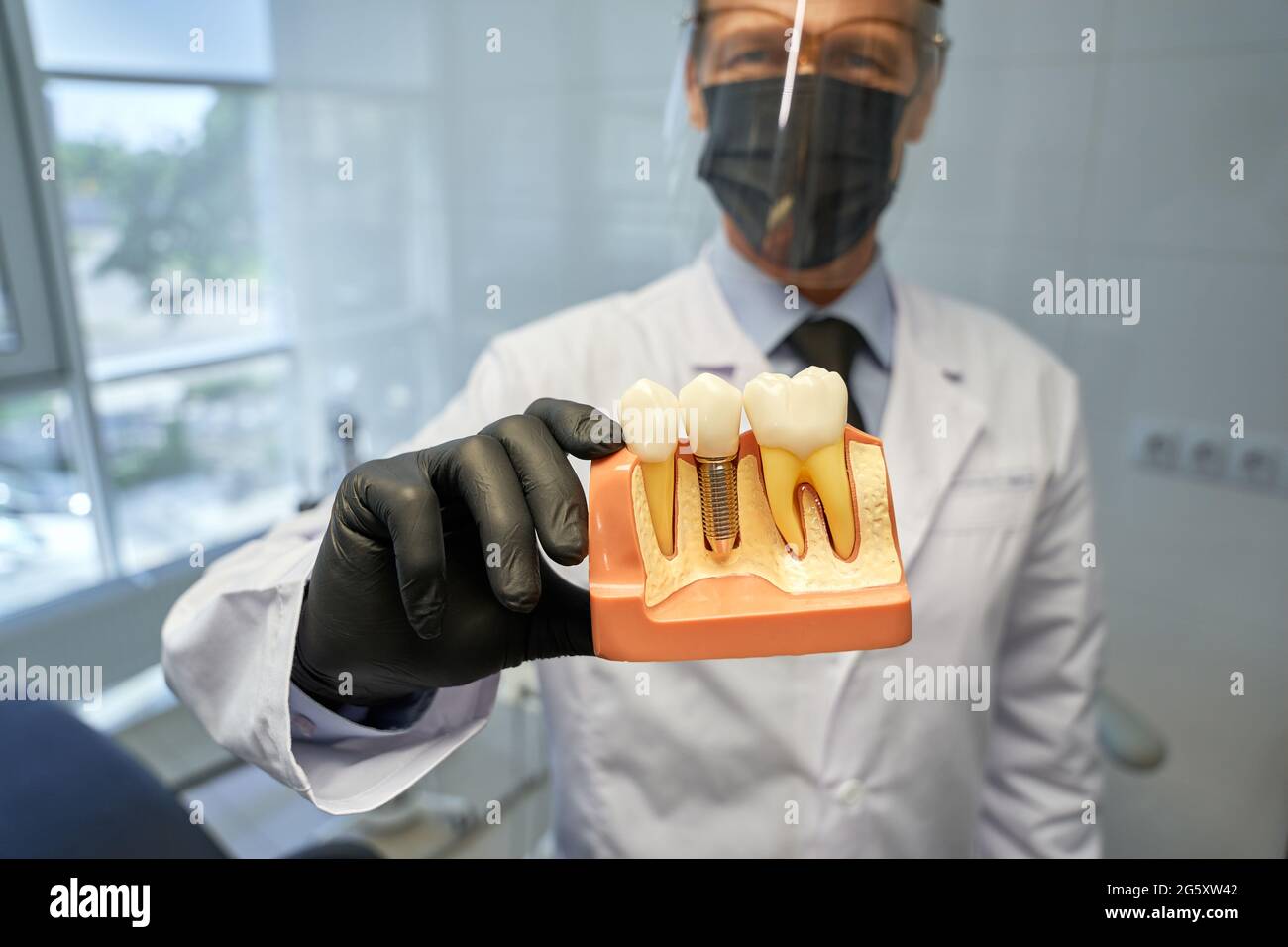 Skilled medical doctor providing visual aid of a dental implant Stock ...