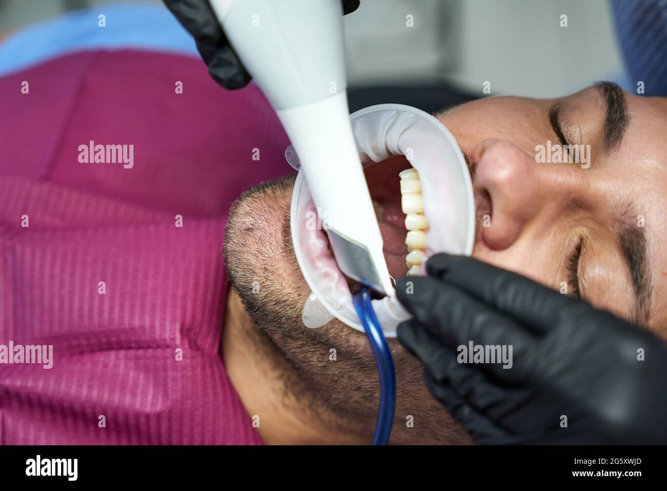 Dental dam hi-res stock photography and images - Alamy