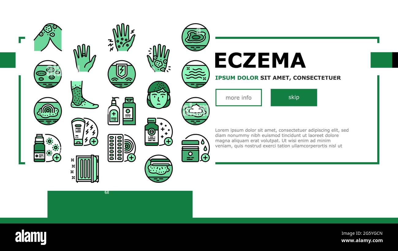 Eczema Disease Treat Landing Header Vector Stock Vector Image And Art Alamy