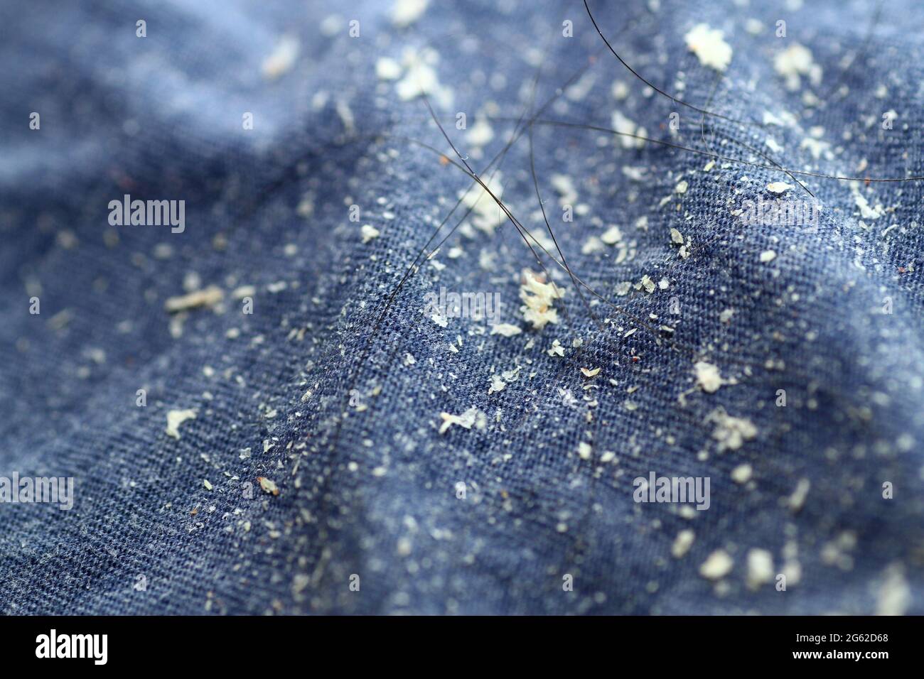 Macro of dandruff or white flakes on cloth Stock Photo - Alamy