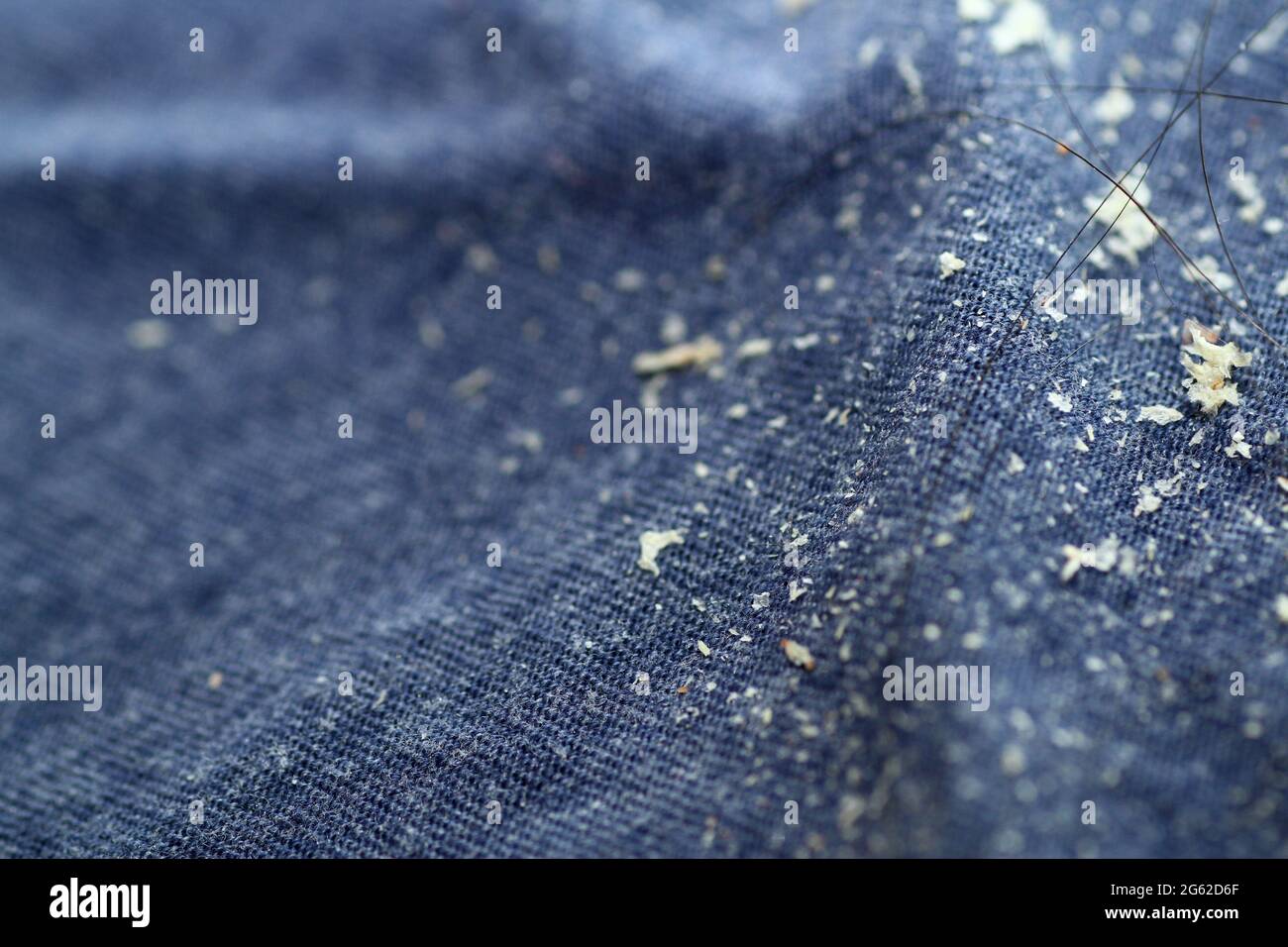 Macro of dandruff or white flakes on cloth Stock Photo - Alamy