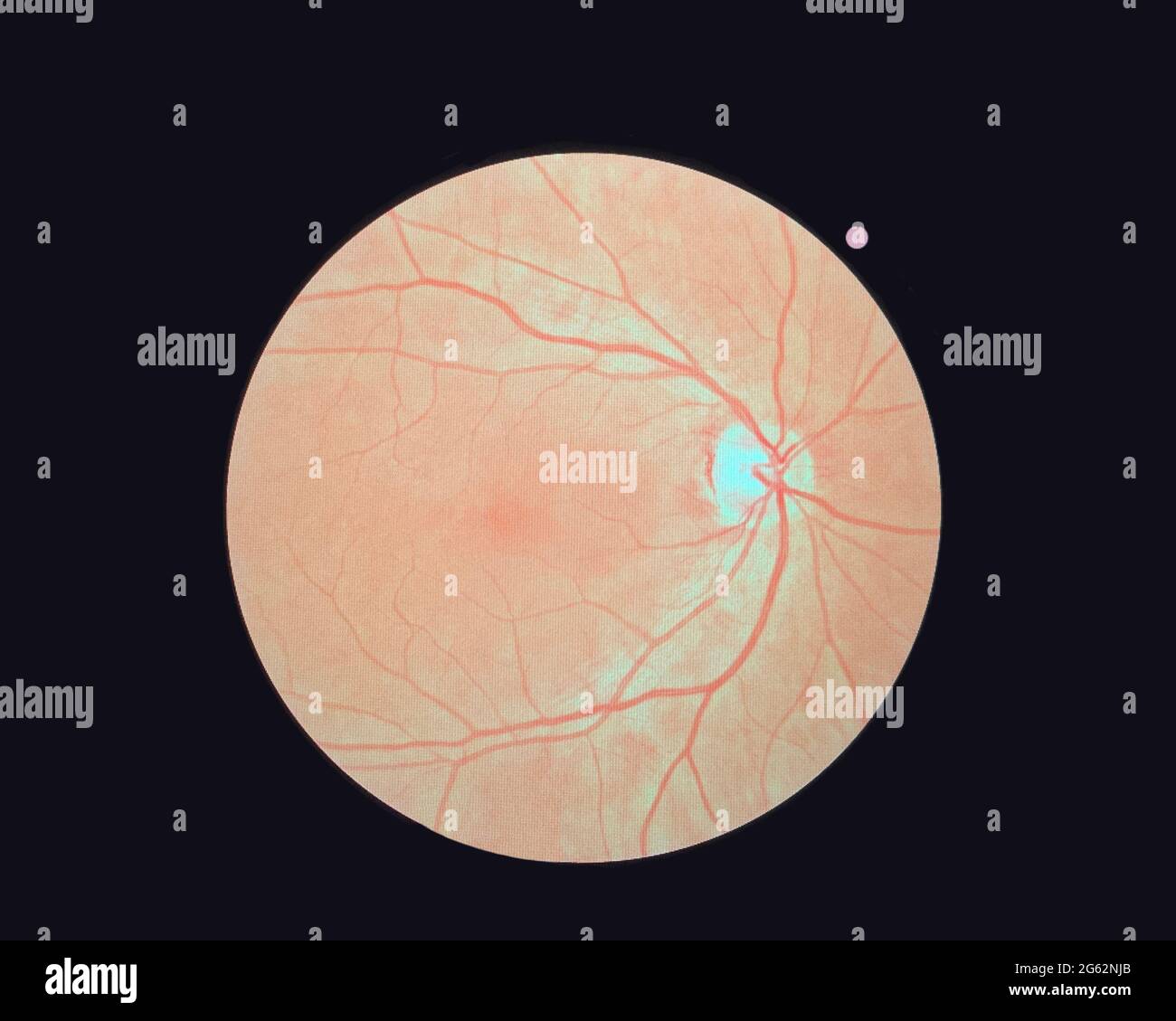 Normal Eye Exam Hi res Stock Photography And Images Alamy