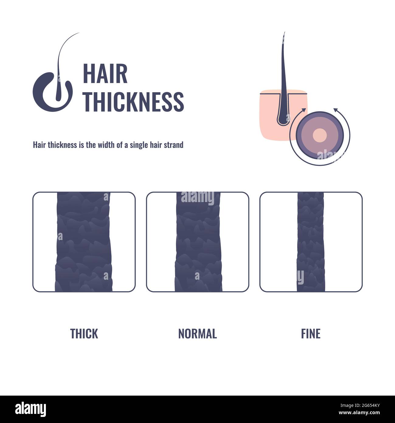 Hair thickness, illustration Stock Photo - Alamy