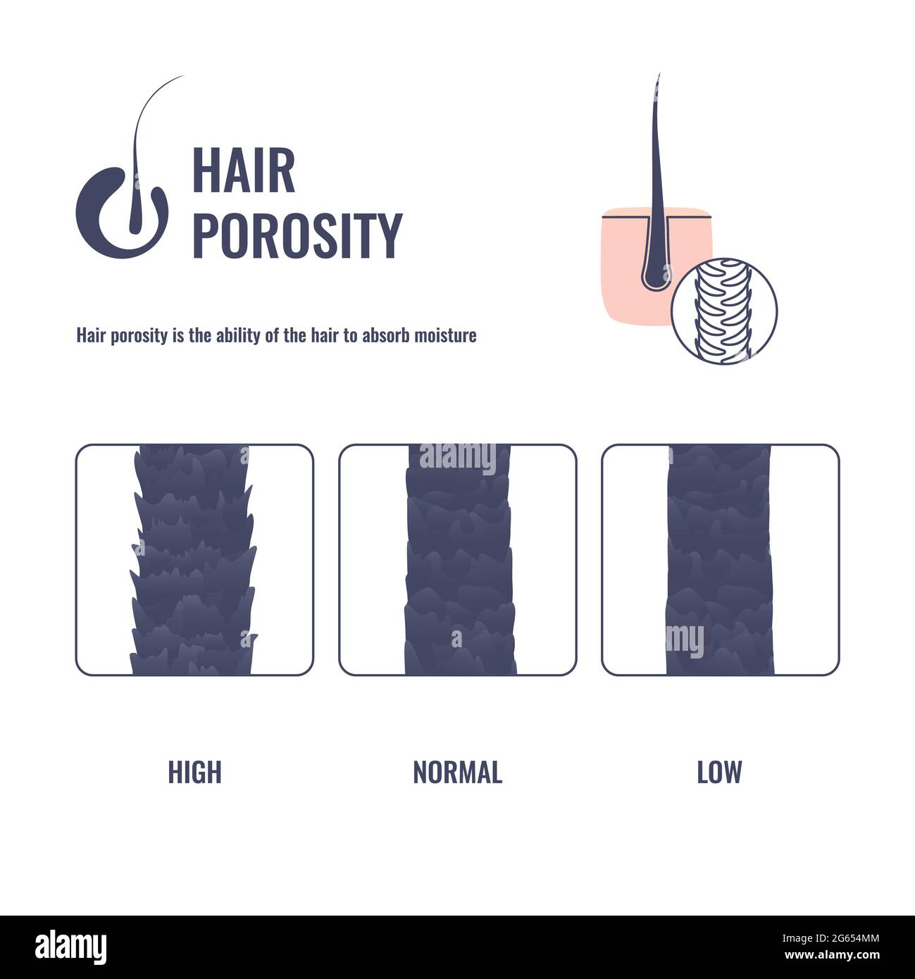 Hair porosity, illustration Stock Photo - Alamy