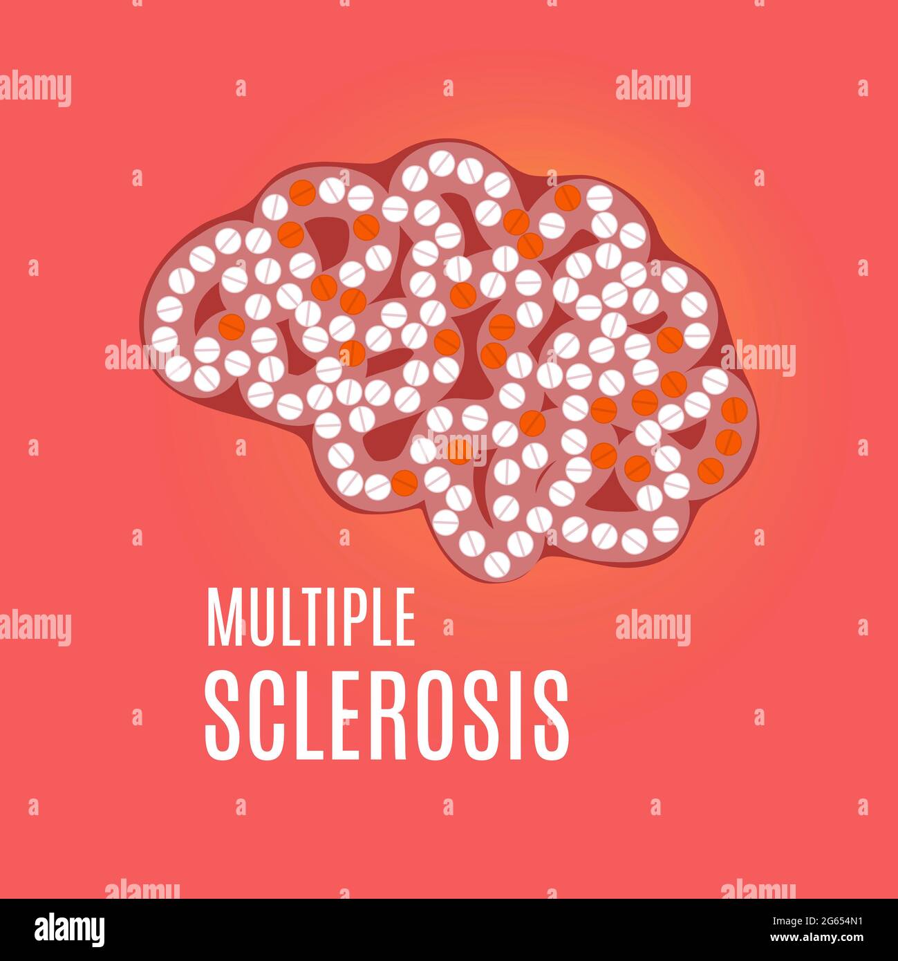Multiple sclerosis, conceptual illustration Stock Photo - Alamy