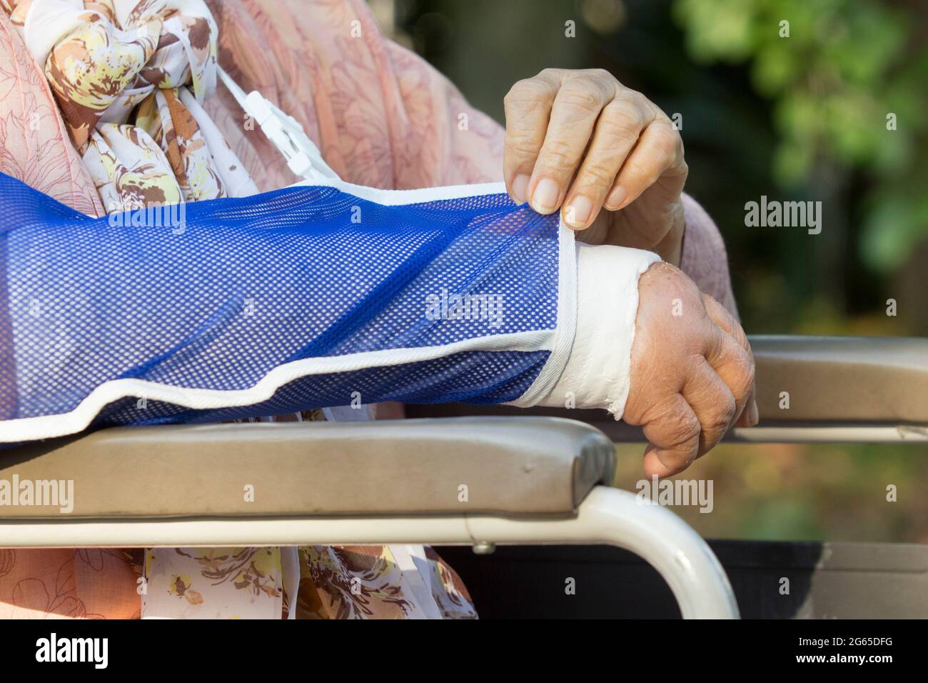 Cast broken bone hispanic hi-res stock photography and images - Alamy