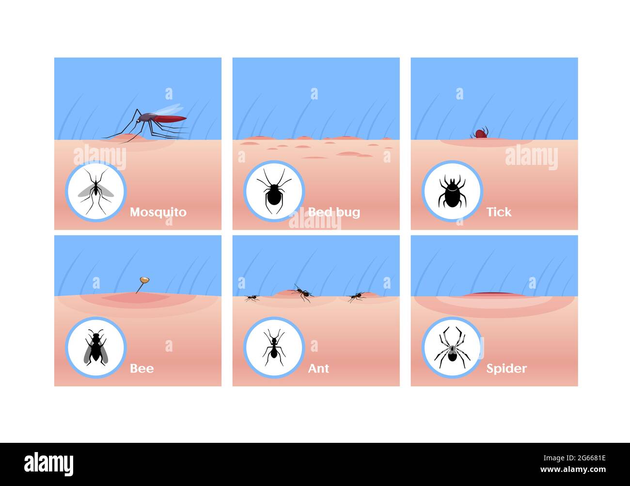 Insect bites flat vector illustrations set. Mosquito drinking blood ...