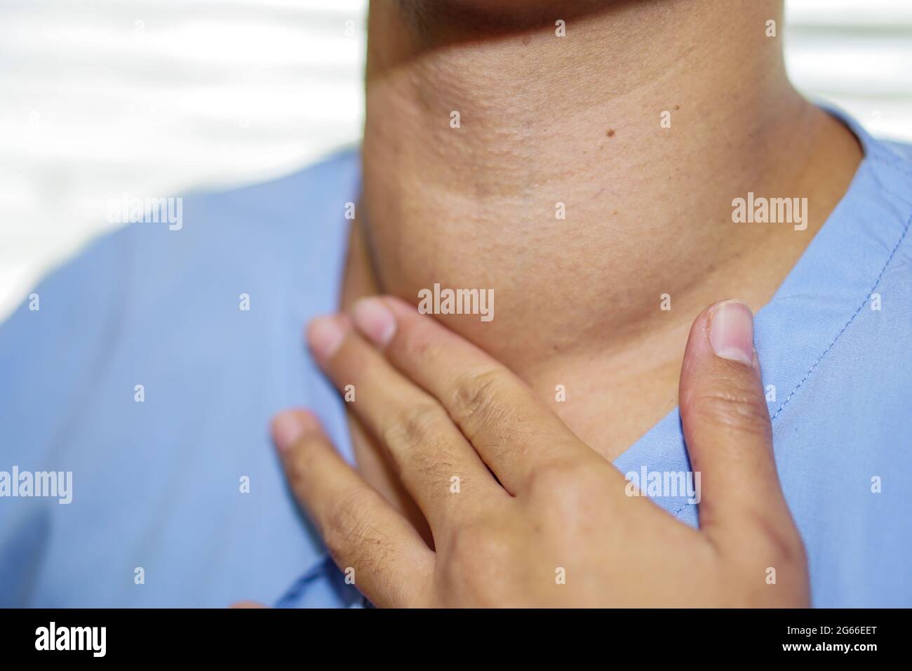Asian lady woman patient have abnormal enlargement of thyroid gland ...