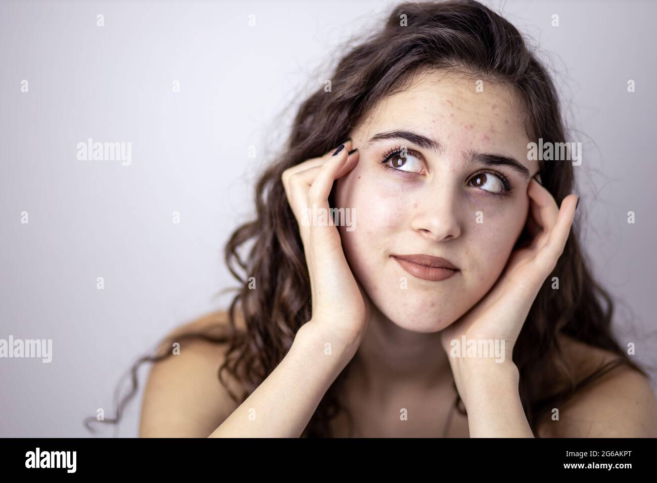 Acne face hi-res stock photography and images - Alamy