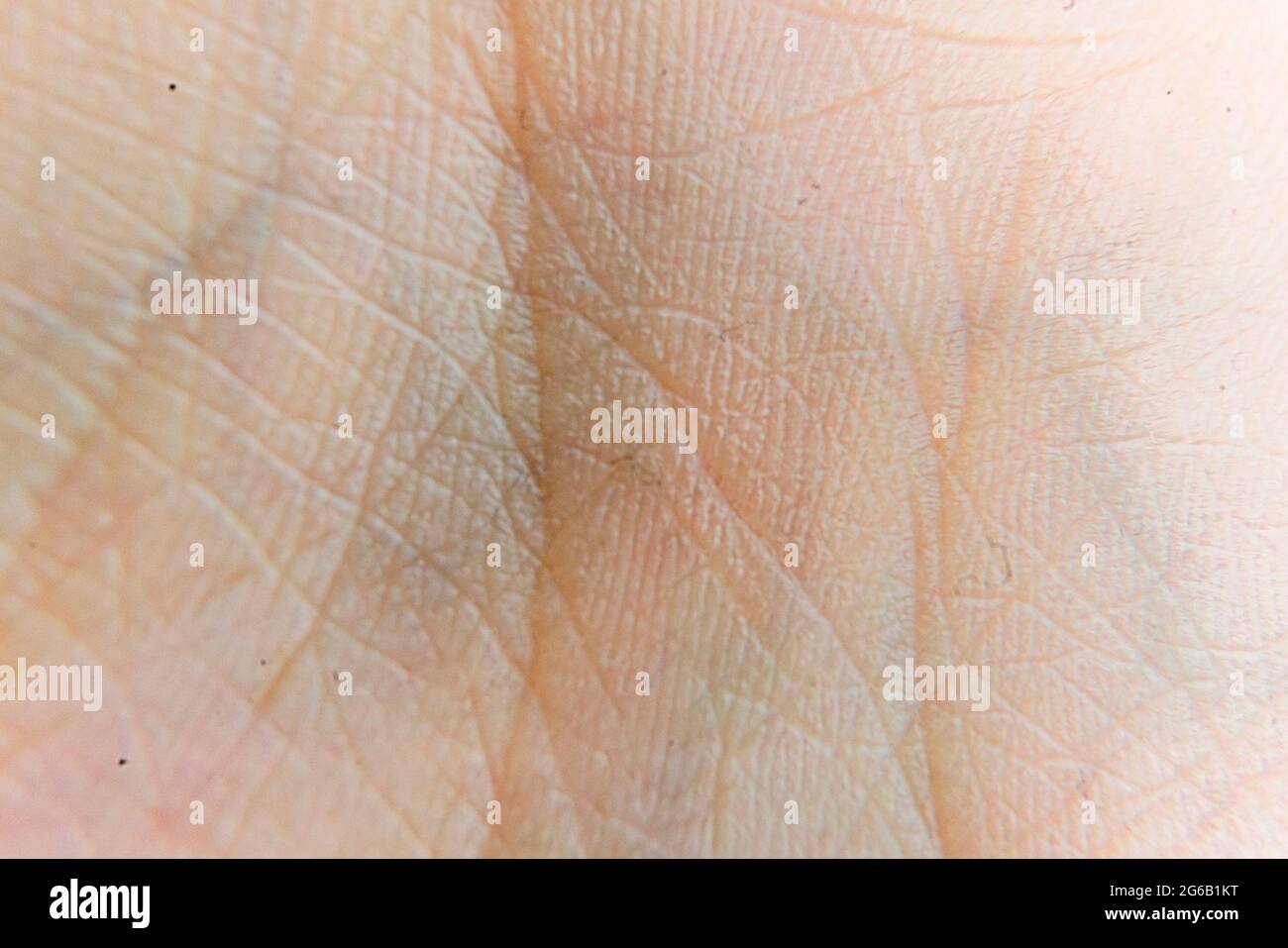 macro photo of a human skin texture Stock Photo - Alamy