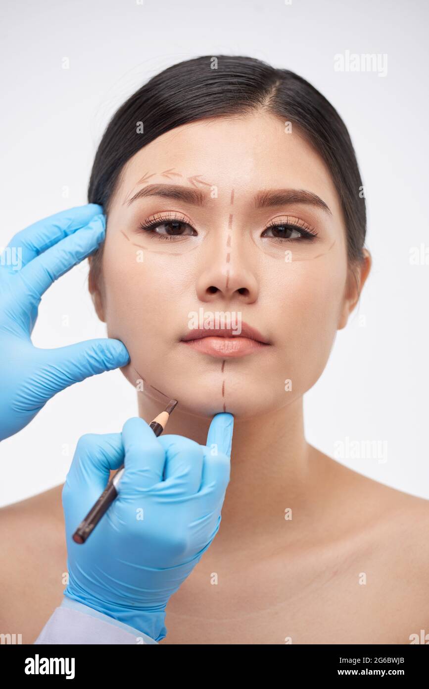Plastic surgeon drawing lines on face of young woman before inject ...