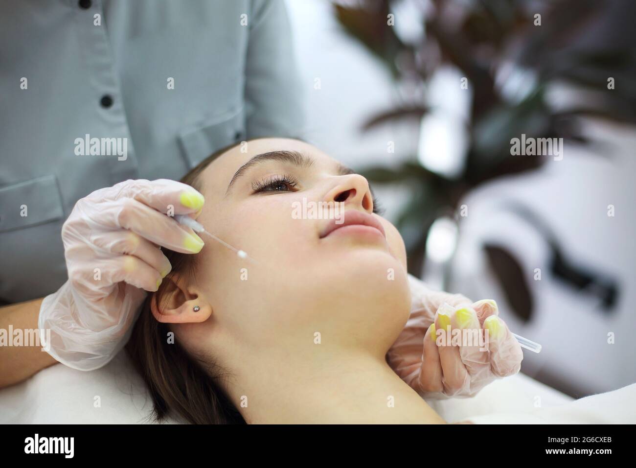 3D Meso Thread Face Lifting Treatment. Mesotherapy in Anti-aging ...
