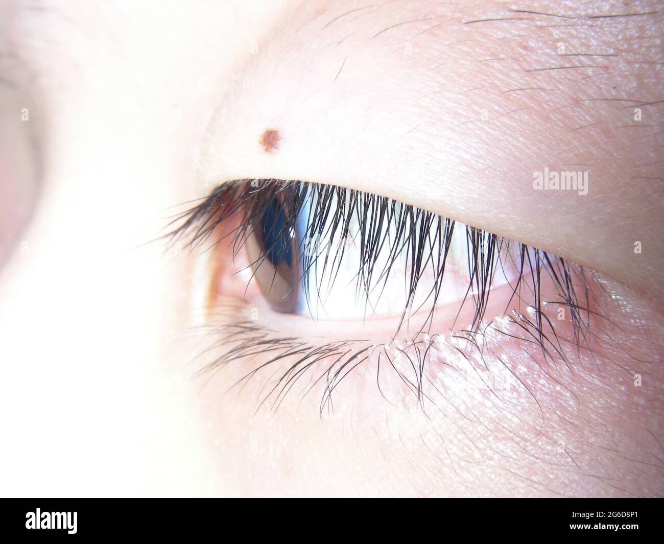 Asian eyelid hi-res stock photography and images - Alamy