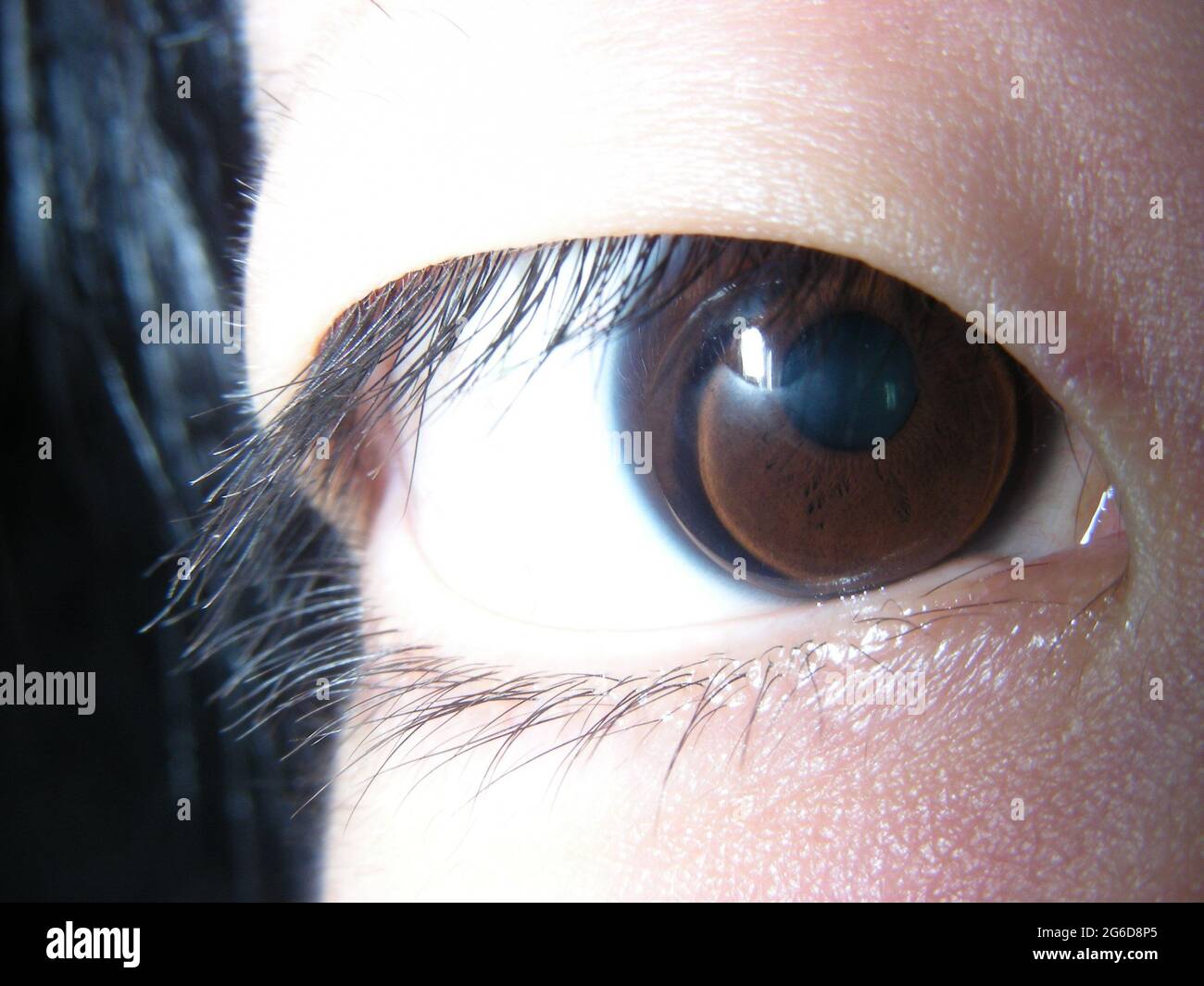 Lens on Eye Ball - Asian Eyelid Stock Photo - Alamy