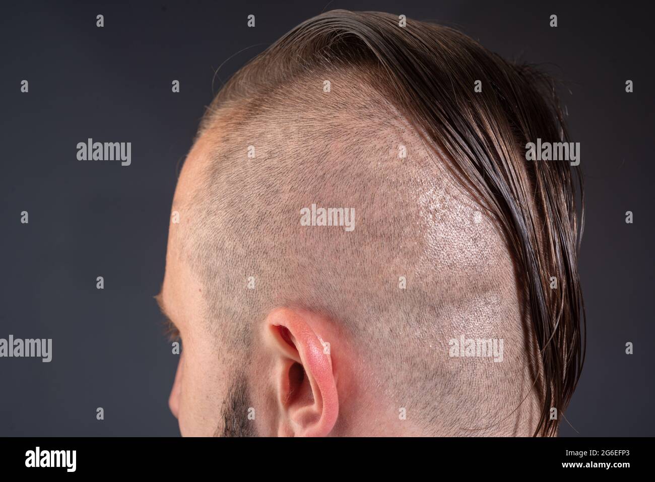 Close up male haircut. Hairstylist bold head. Barbershop concept. Man ...