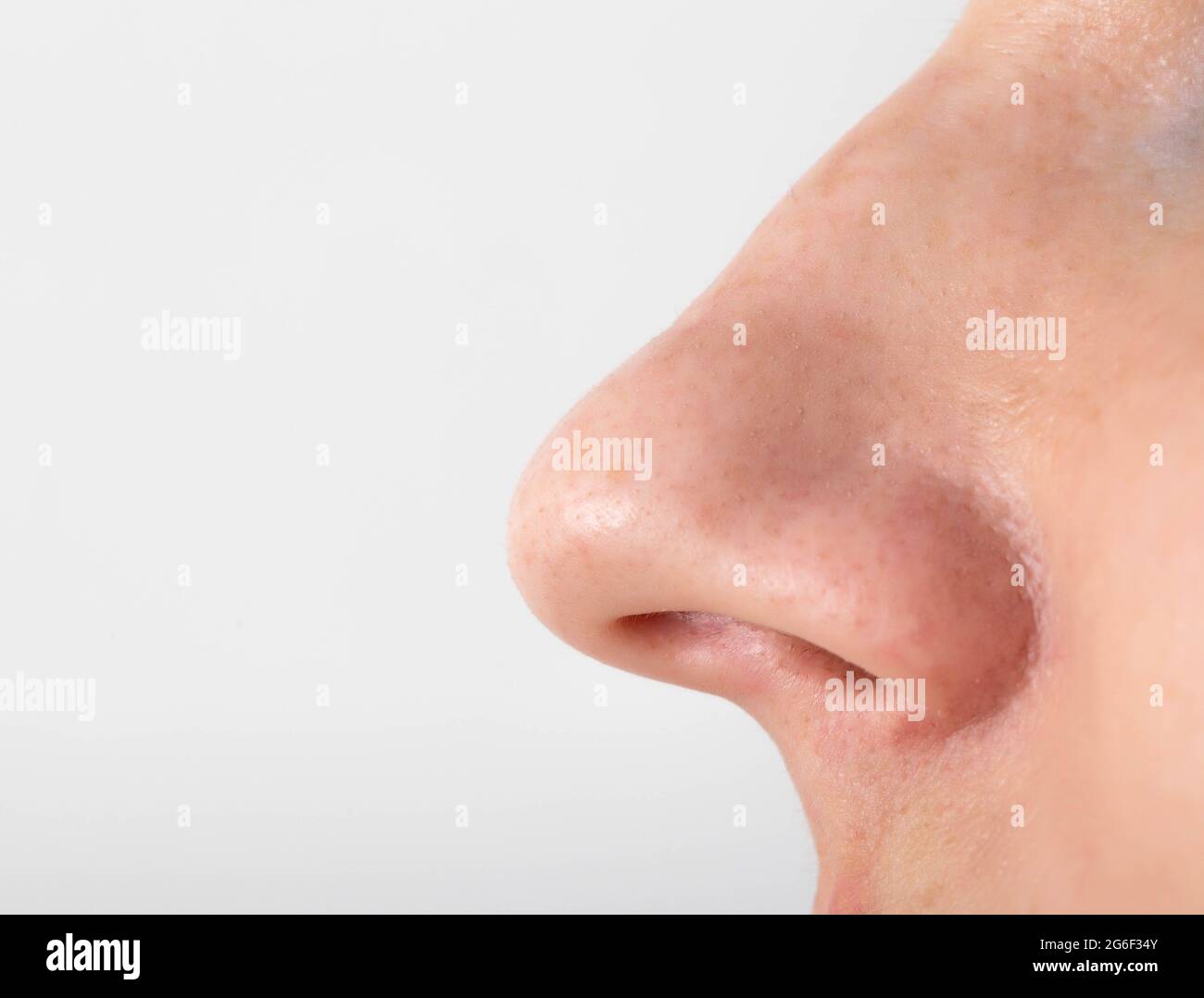 The girl has a long nose, close-up. Nose reduction plastic surgery ...