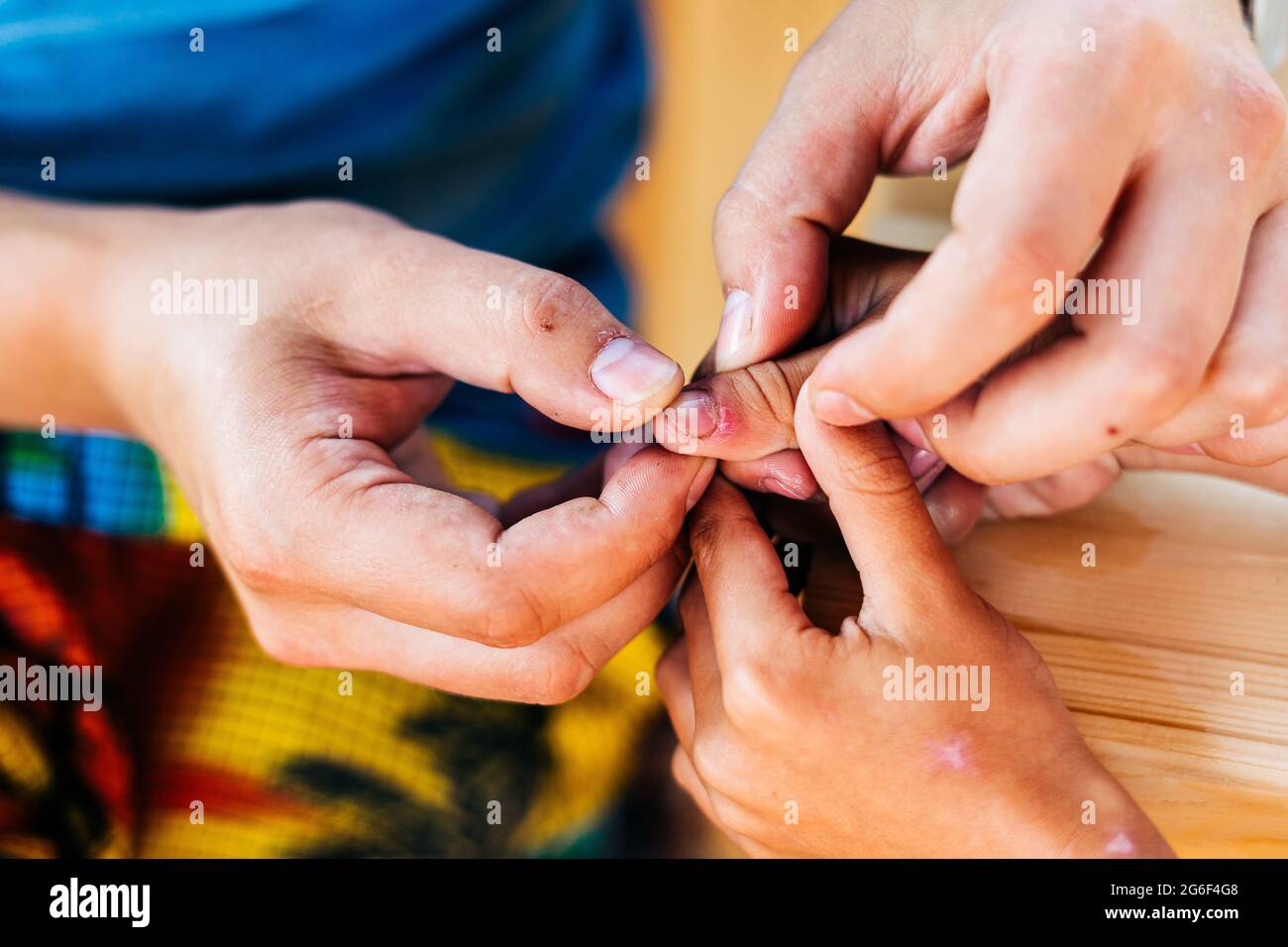Child boy injuring his hand. Father provides first aid Stock Photo - Alamy