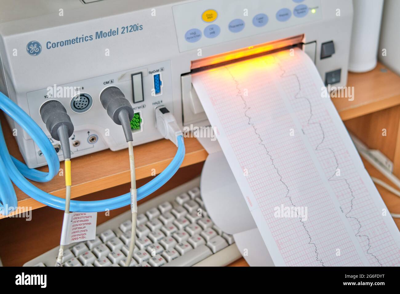 CTG device with monitoring of the state of health of the mother and ...
