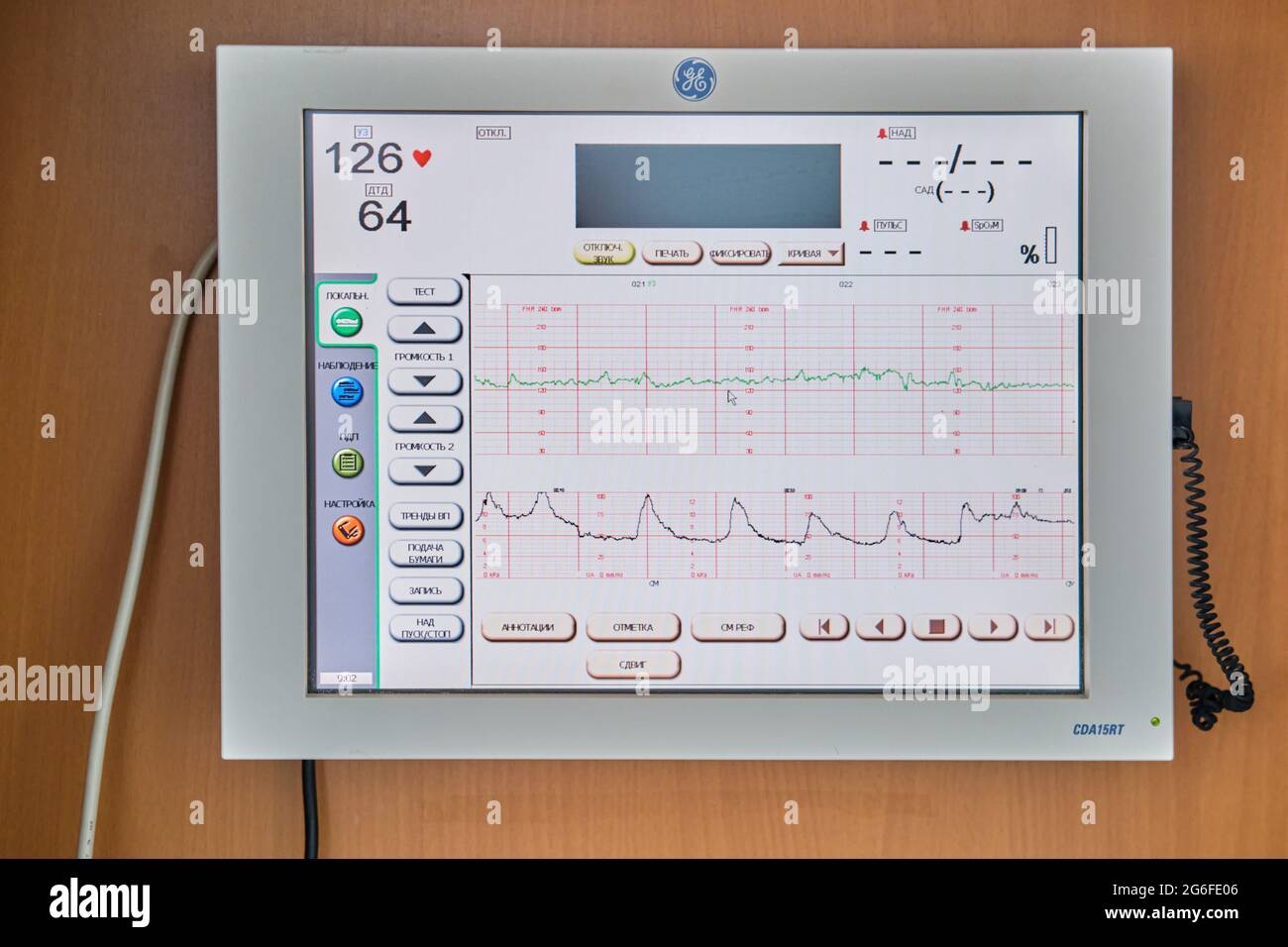 CTG device with monitoring of the state of health of the mother and ...