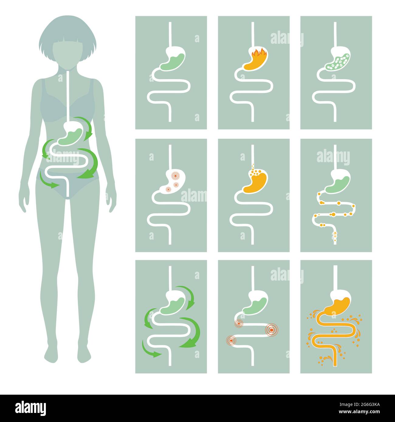 human digestive system, vector illustration of digestion tract disease ...