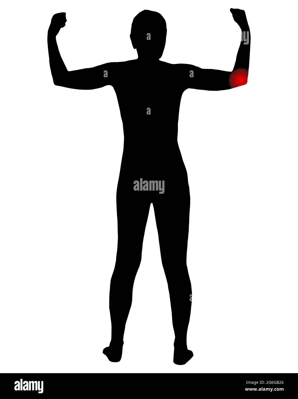 Back view of woman with with symbol for elbow pain Stock Photo - Alamy