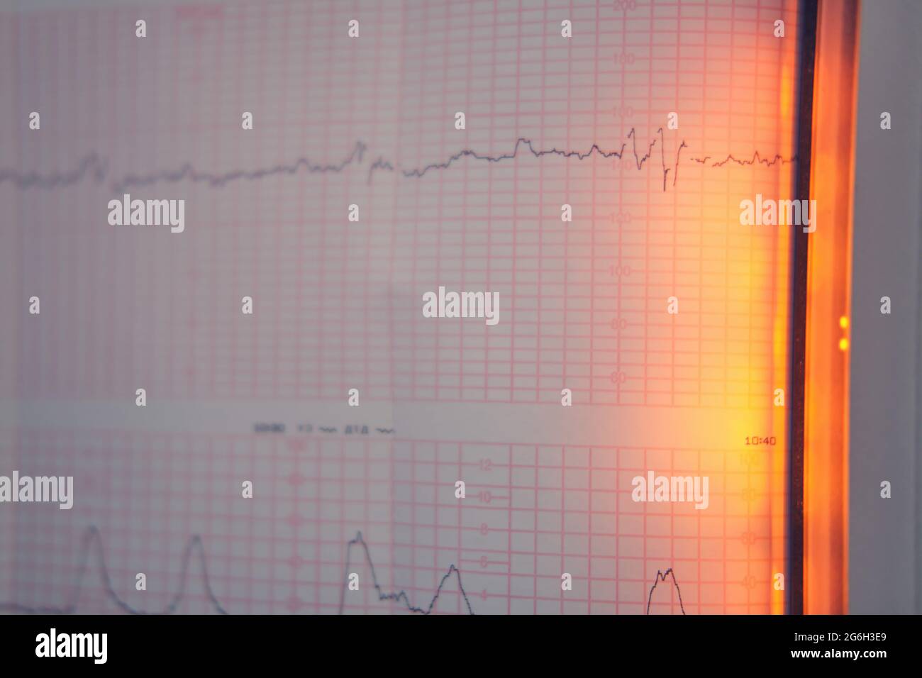 CTG device with monitoring of the state of health of the mother and ...