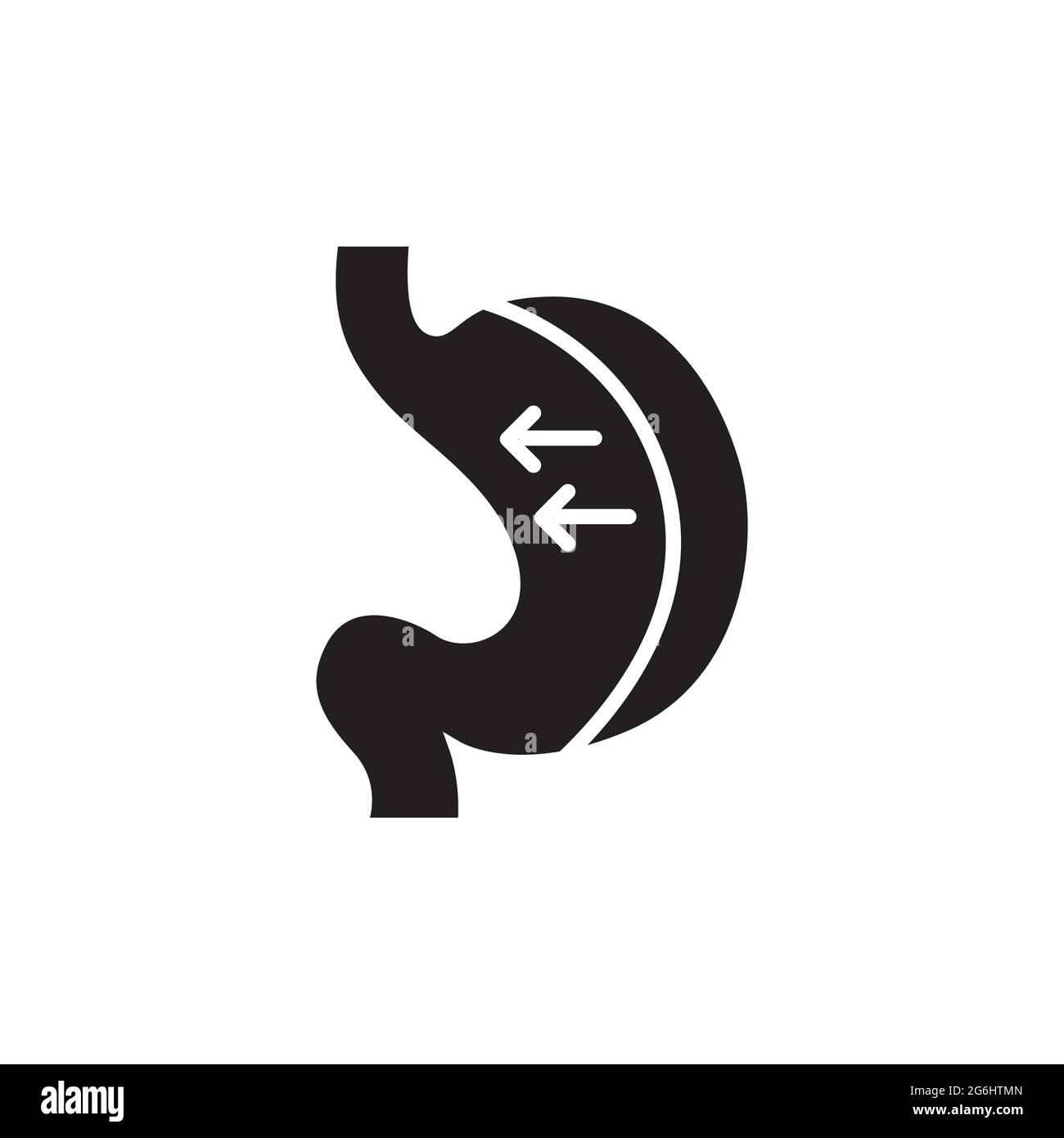 Gastrectomy illustration hi-res stock photography and images - Alamy
