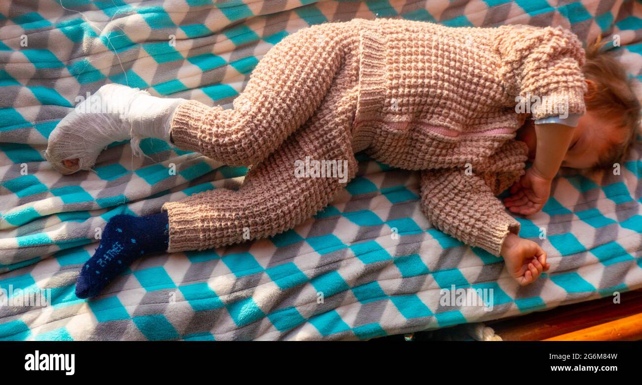 Child with bandage on leg heel fracture. Broken right foot, bone, calf ...