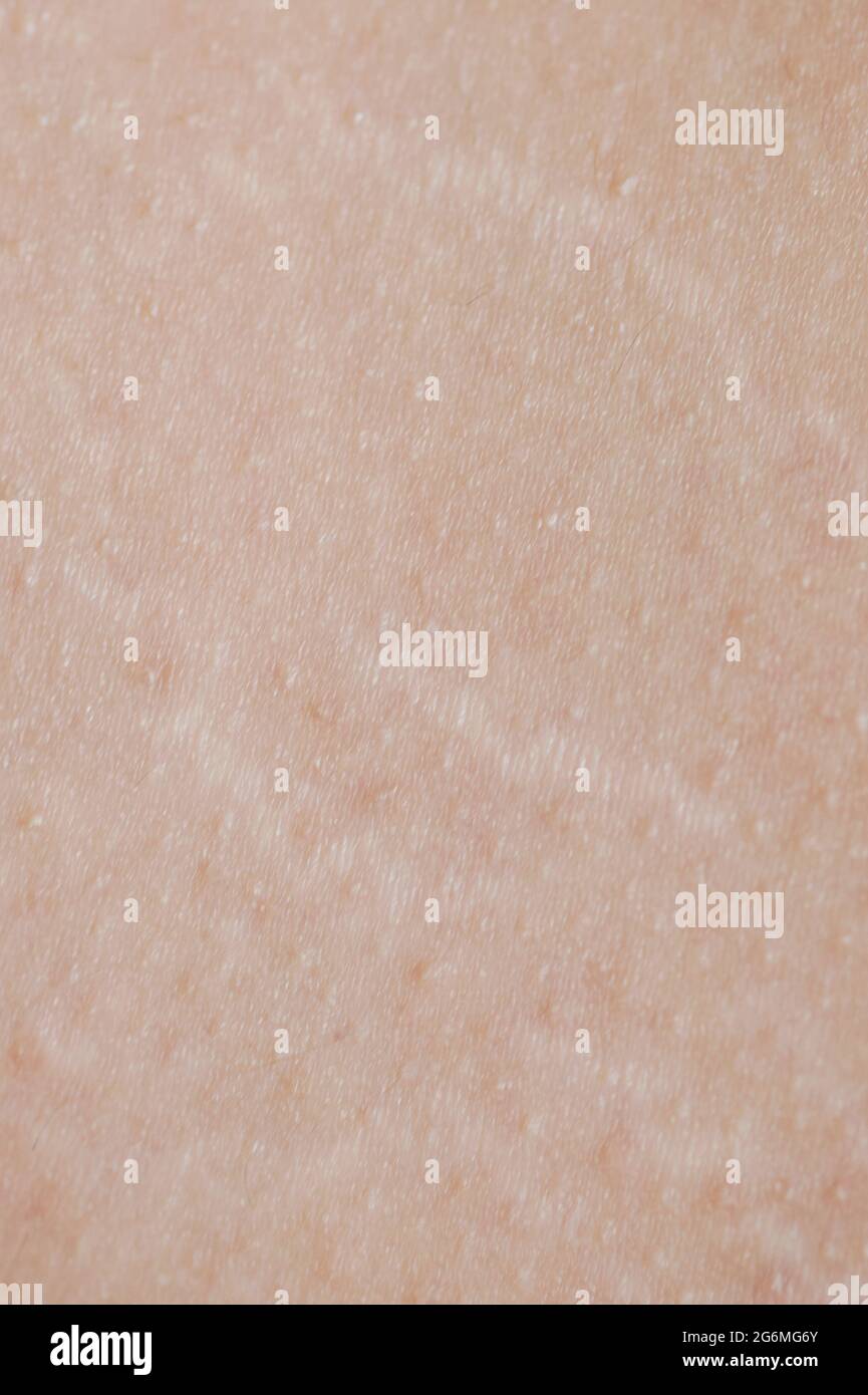 Stretch mark hi-res stock photography and images - Alamy