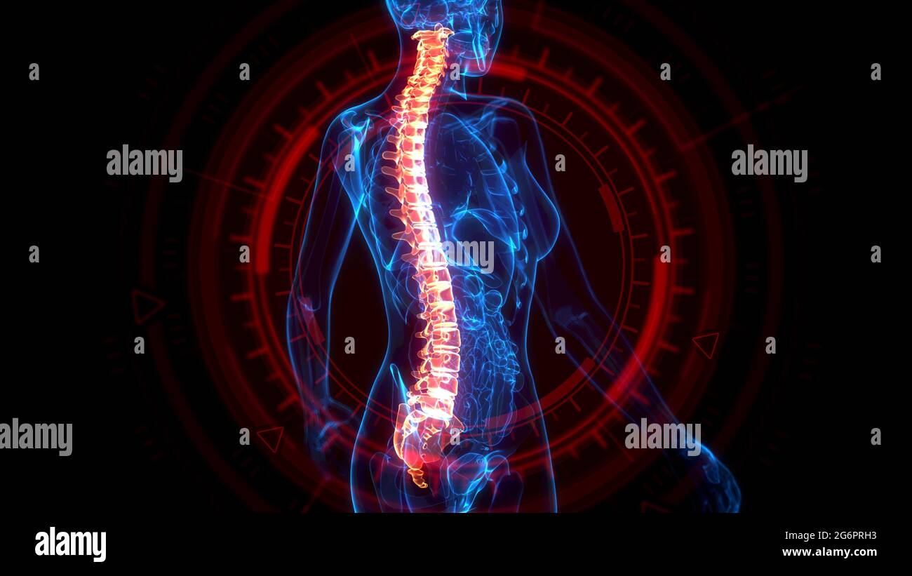 cg medical 3d illustration, spine on x ray human body Stock Photo - Alamy