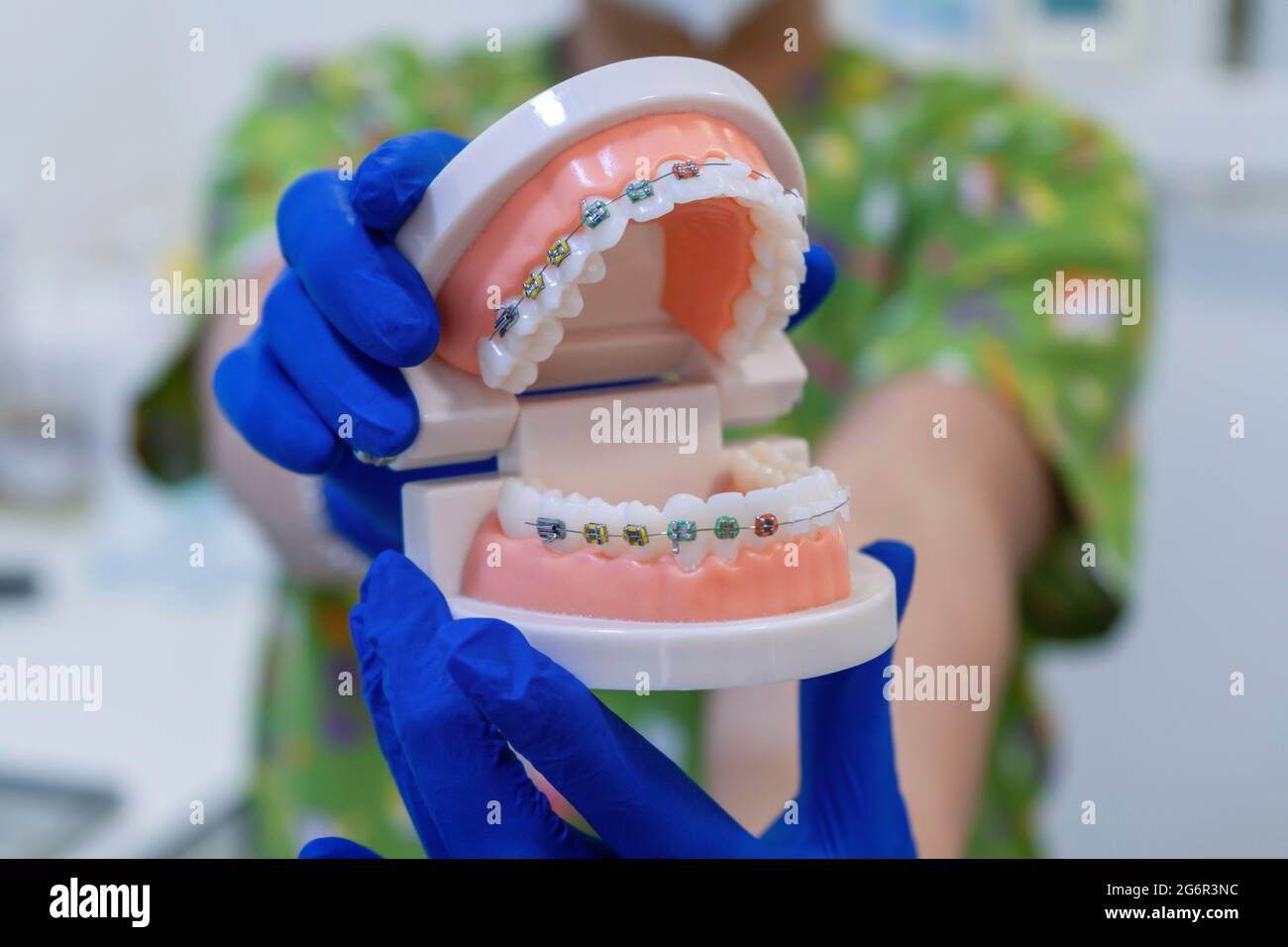 Doctor showing denture teeth with dental braces and transparent ...