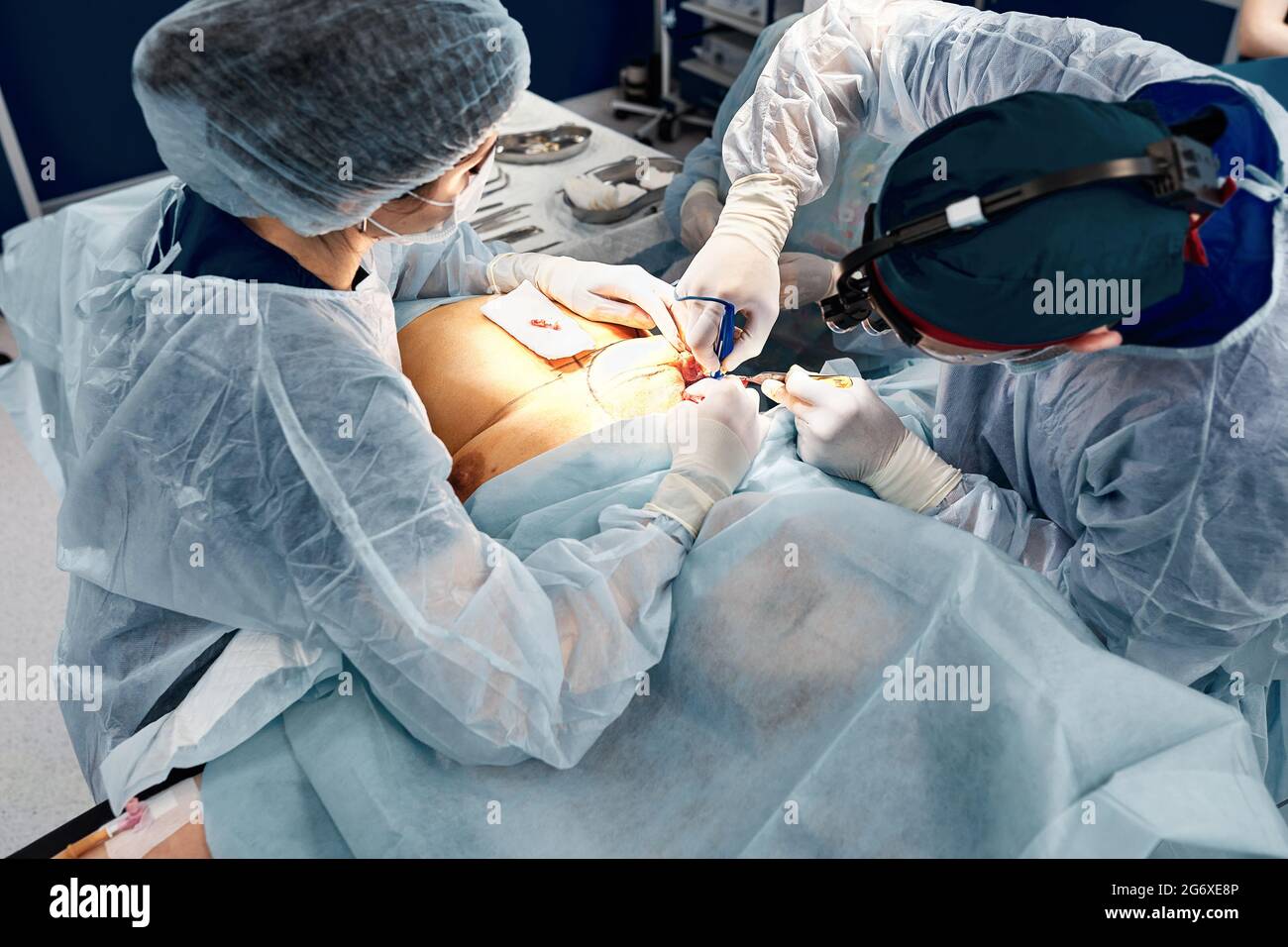 The hard work of a team of surgeons, the hard work of professional ...