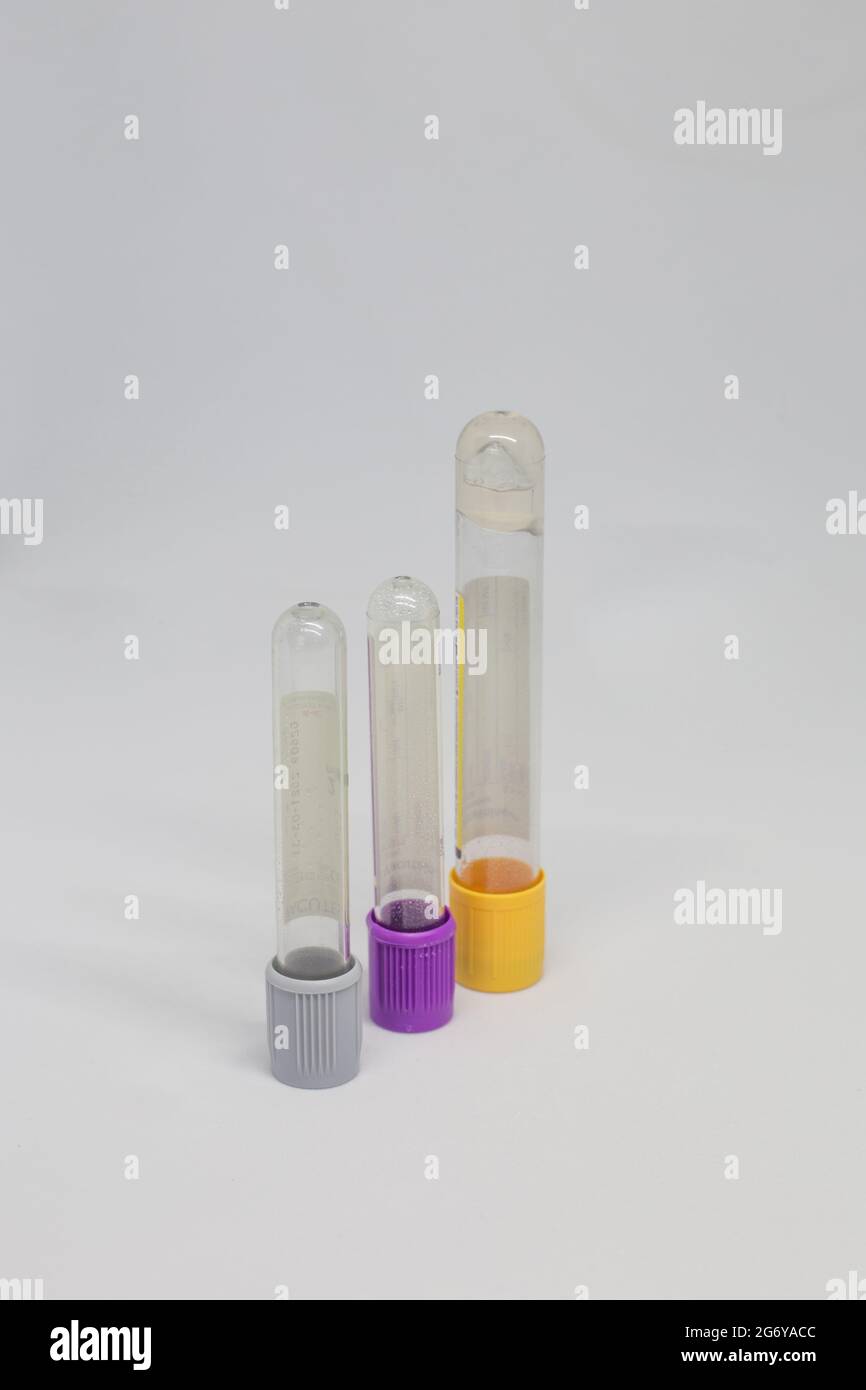 Top view of medical empty blood tubes isolated on white background ...