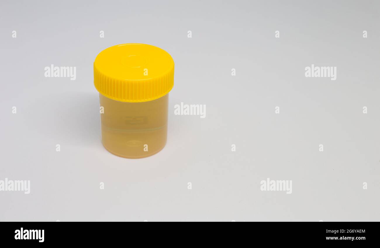 Closeup of a medical container with urine isolated on white background ...