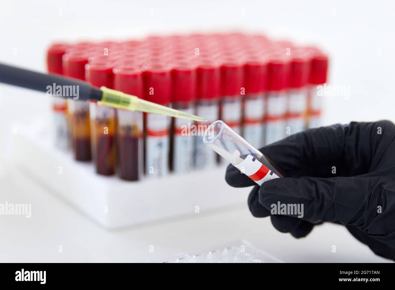 hands of a lab technician with tube of blood sample and rack with other ...