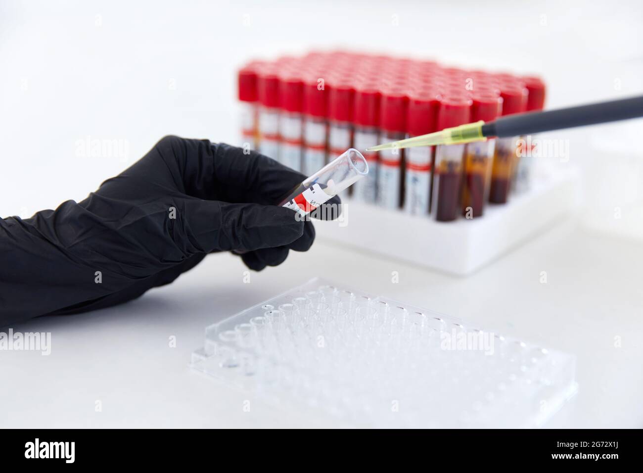 Blood test concept. hands of a lab technician with tube of blood sample ...