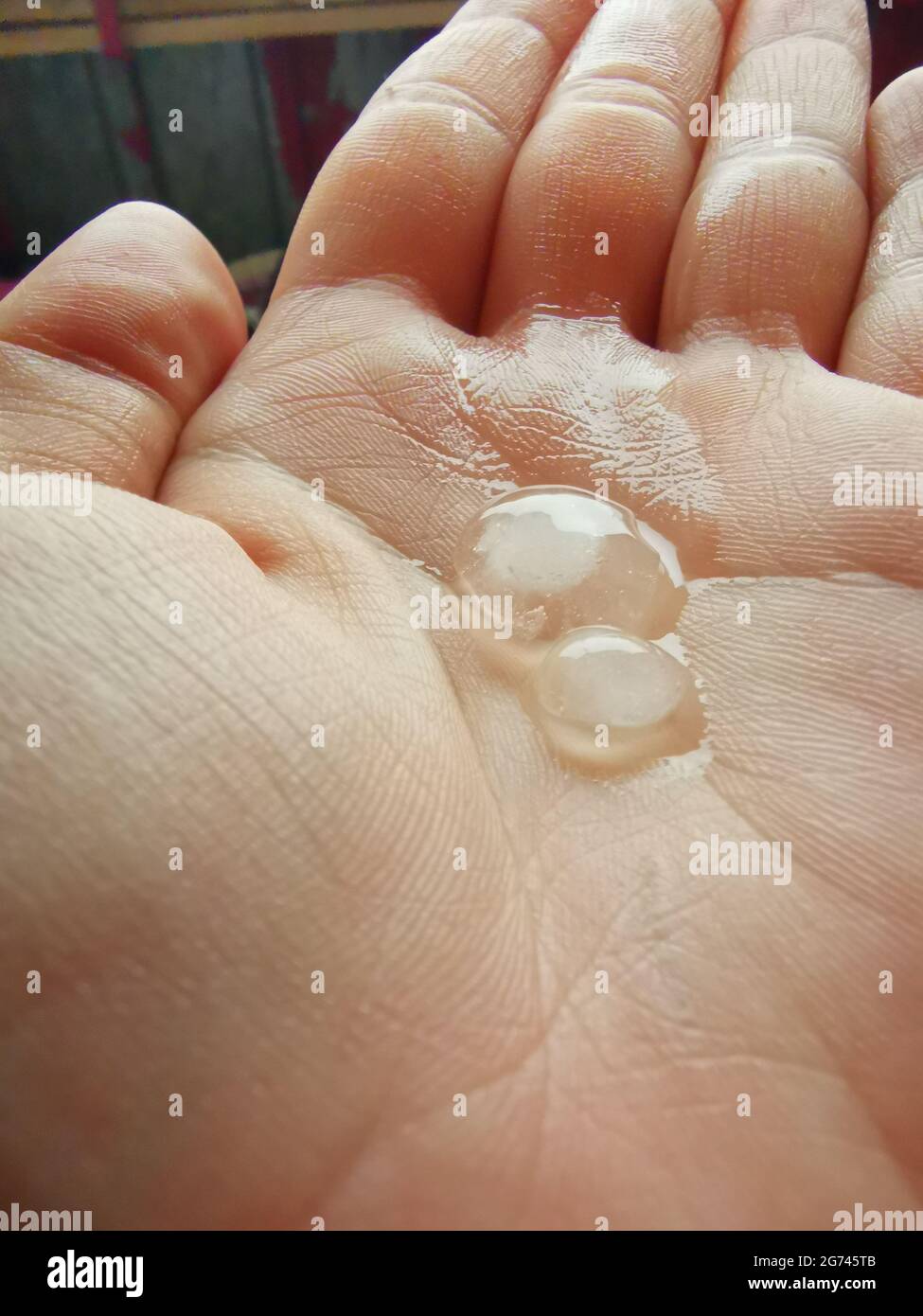 A vertical shot of melting hail balls in a palm Stock Photo - Alamy
