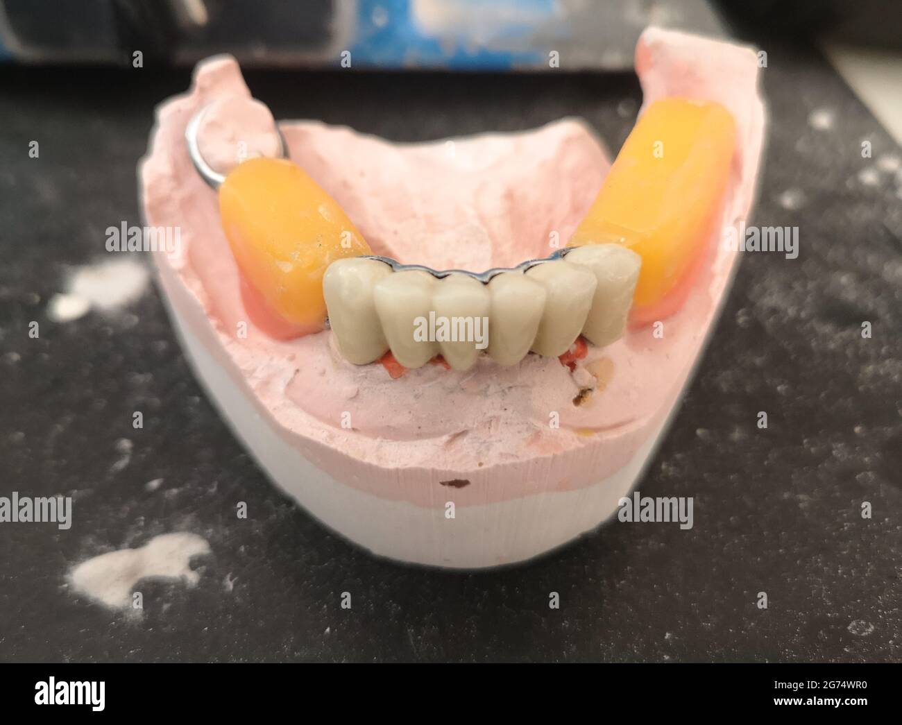 A closeup of dental laboratory prosthesis and equipment Stock Photo - Alamy