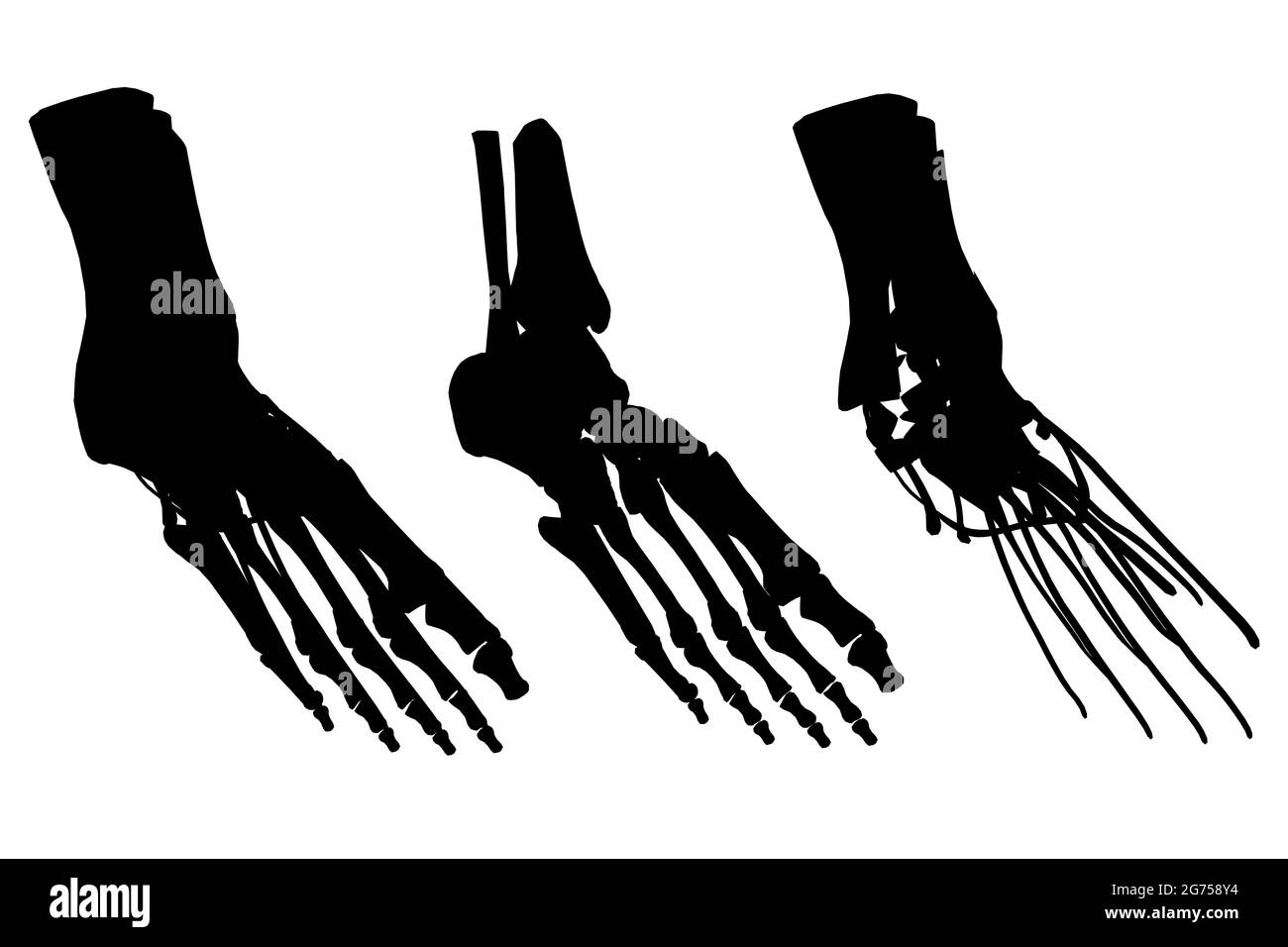 Set of silhouettes human leg skeleton with muscles isolated on white ...