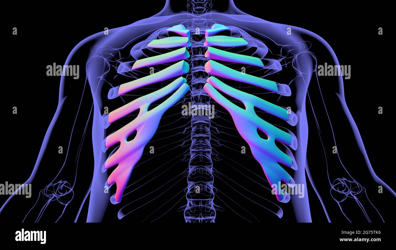 Costochondral Junction