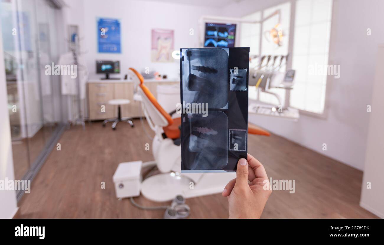 Medical radiography hi-res stock photography and images - Alamy